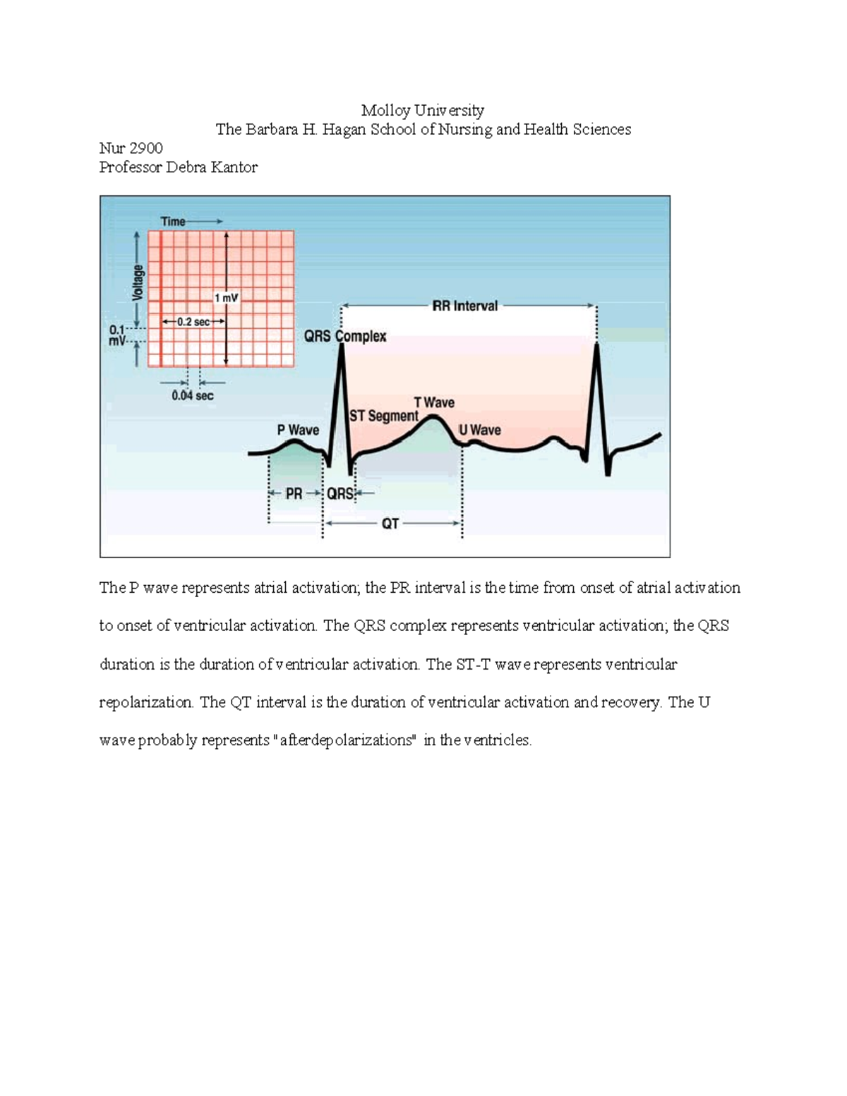 Nur 2900 EKG Interpretation: Understanding Cardiac Waveforms - Studocu