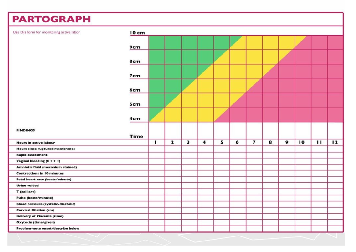 Labor Monitoring: Partograph Guidelines and Findings - Studocu