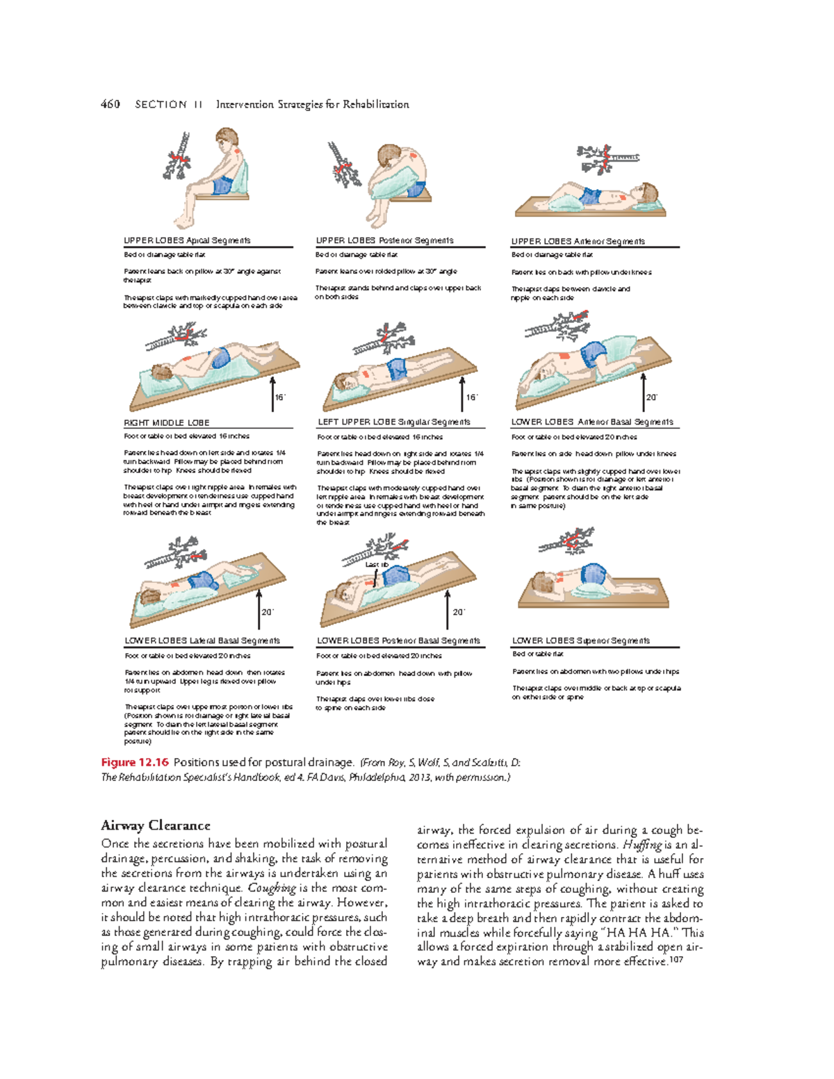 Postural Drainage Positions for Rehabilitation (3:03 PM) - Studocu
