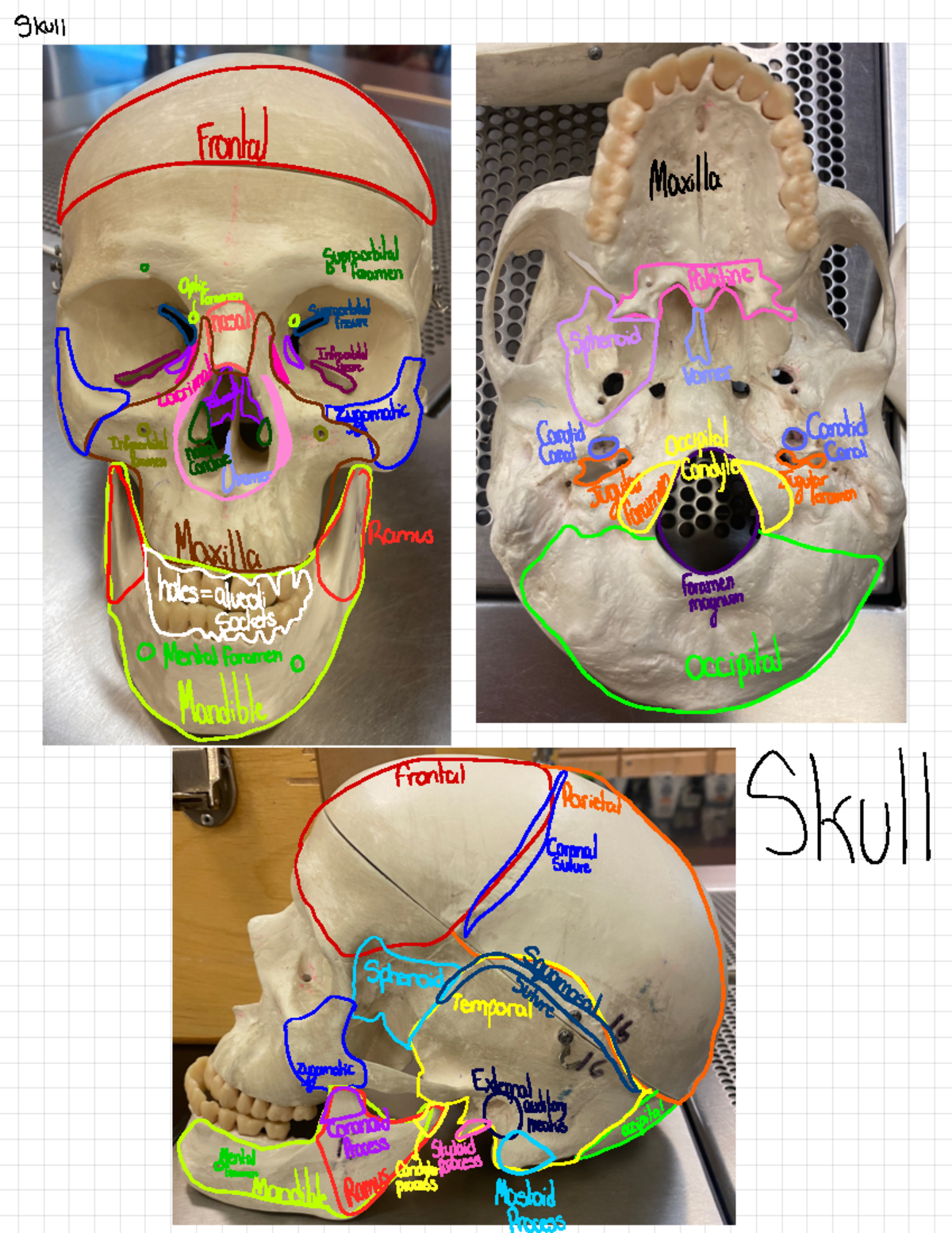 A&P Lab 4: Detailed Overview of Human Bones and Anatomy - Studocu
