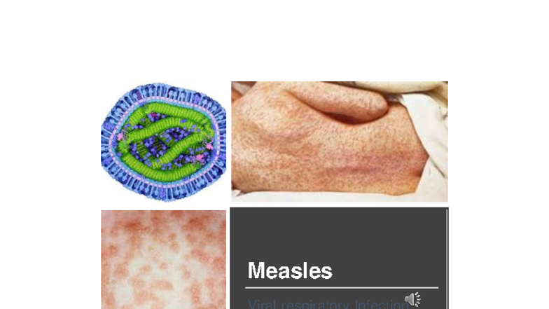 Measles (Rubeola) - Comprehensive Study Notes on Infection and ...