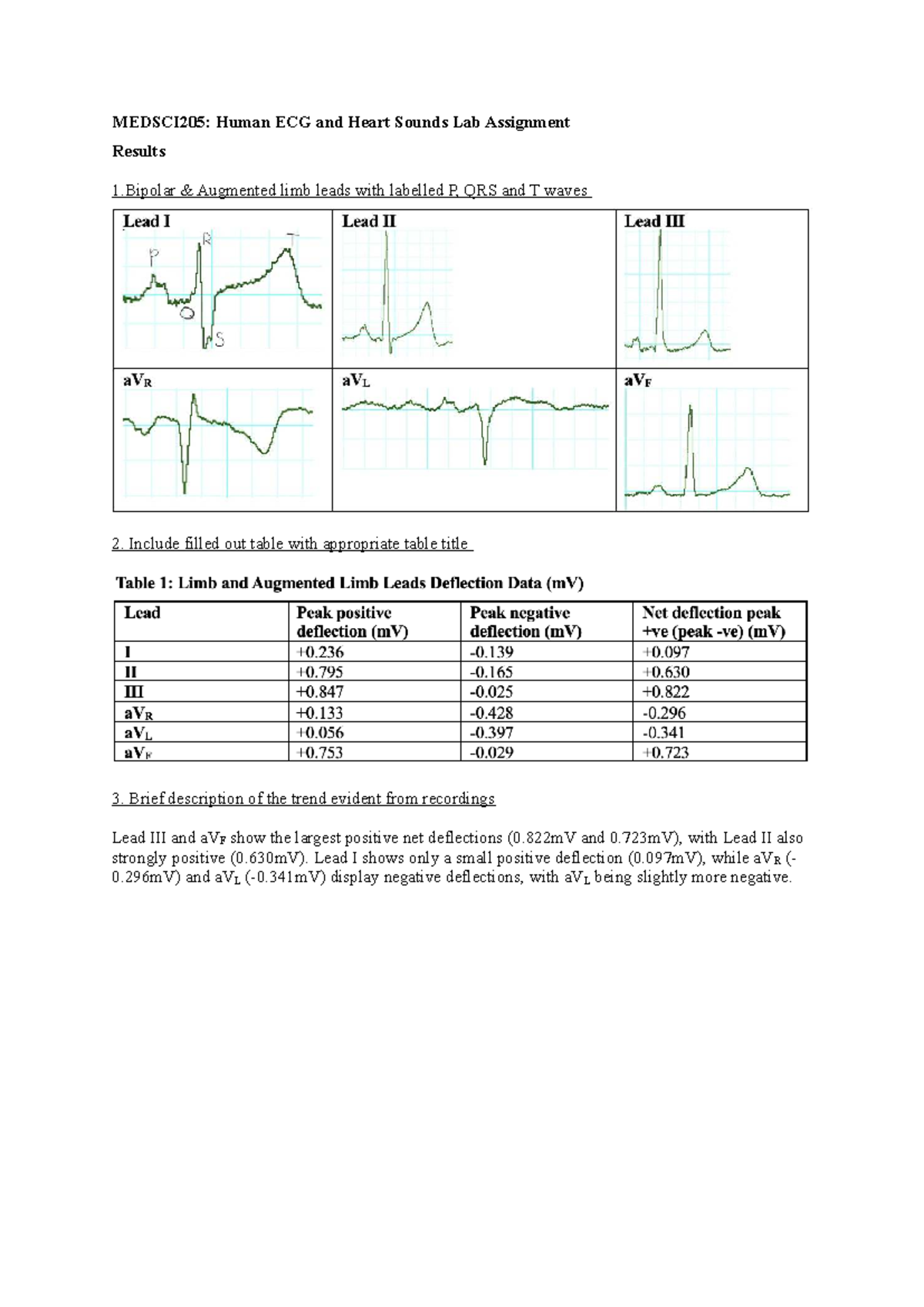 MEDSCI205: Human ECG Lab Report on Heart Sounds and Vector Analysis ...