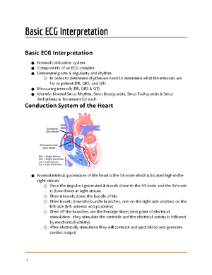 EKG Dysrhythmias Strips: PAC, Atrial Fibrillation, Flutter, SVT, PAT ...