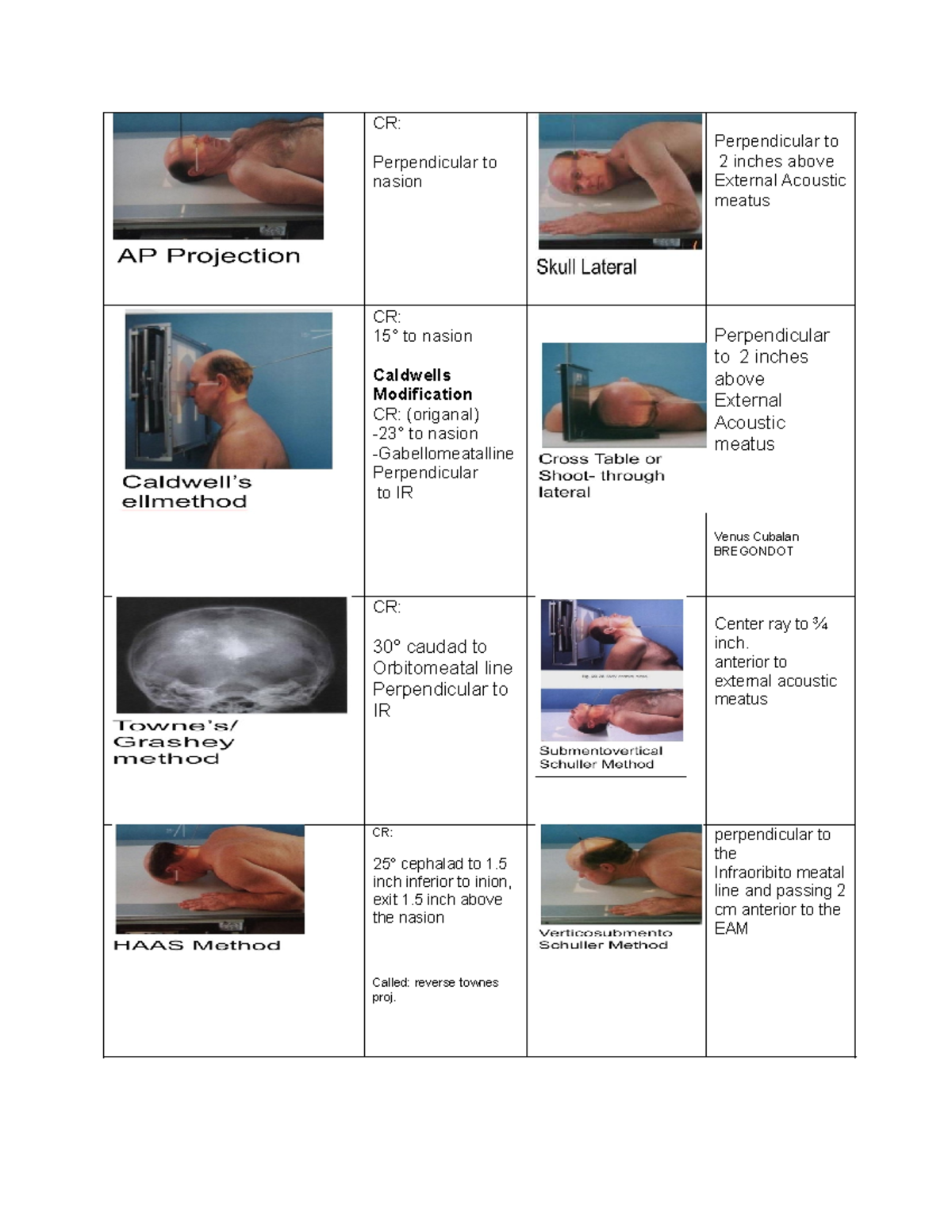 CR: Skull Positioning Techniques and Projections Overview - Studocu