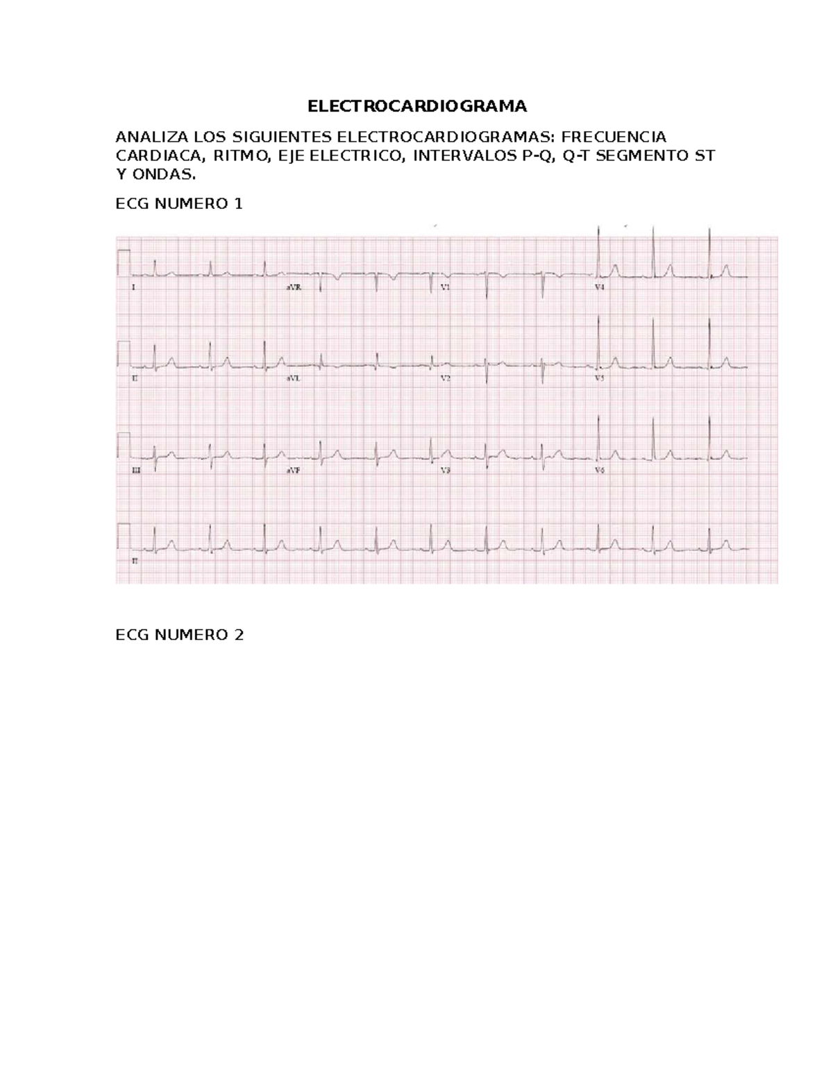 ECG - Gujtgnuj - Fisiología I - ELECTROCARDIOGRAMA ANALIZA LOS ...