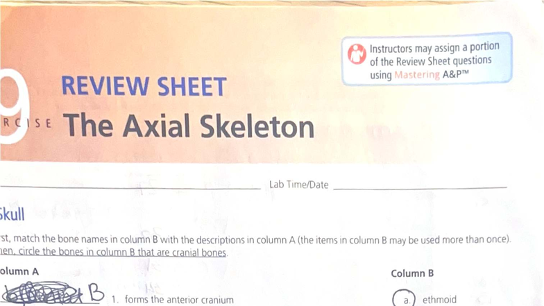 Exercise 9 Review Sheet: Axial Skeleton Lab and Vertebral Column ...