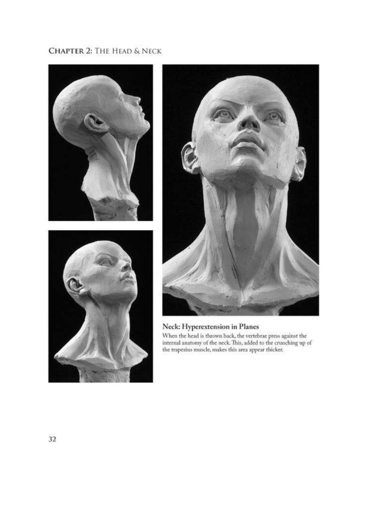 CHAPTER 2: HEAD & NECK - Hyperextension & Figure Sculpting Techniques ...