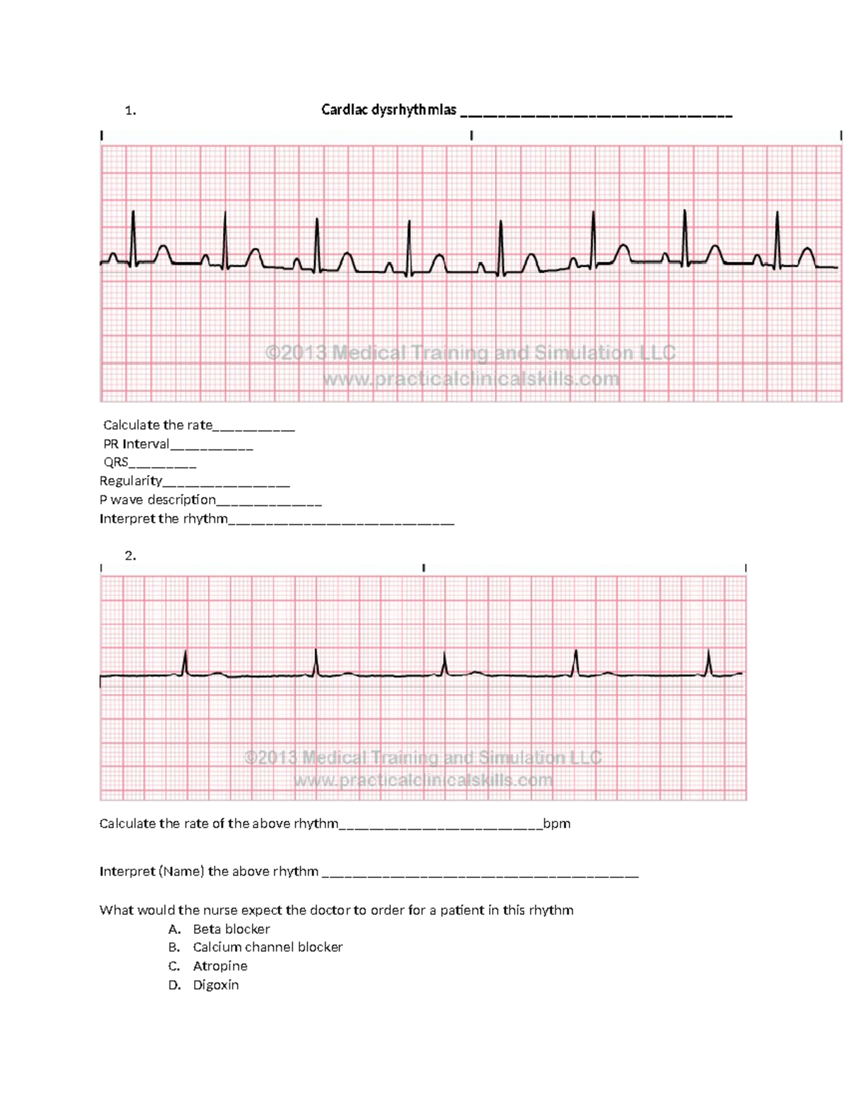 Cardiac Rhythms Practice for Exam 1: Key Concepts & Questions - Studocu