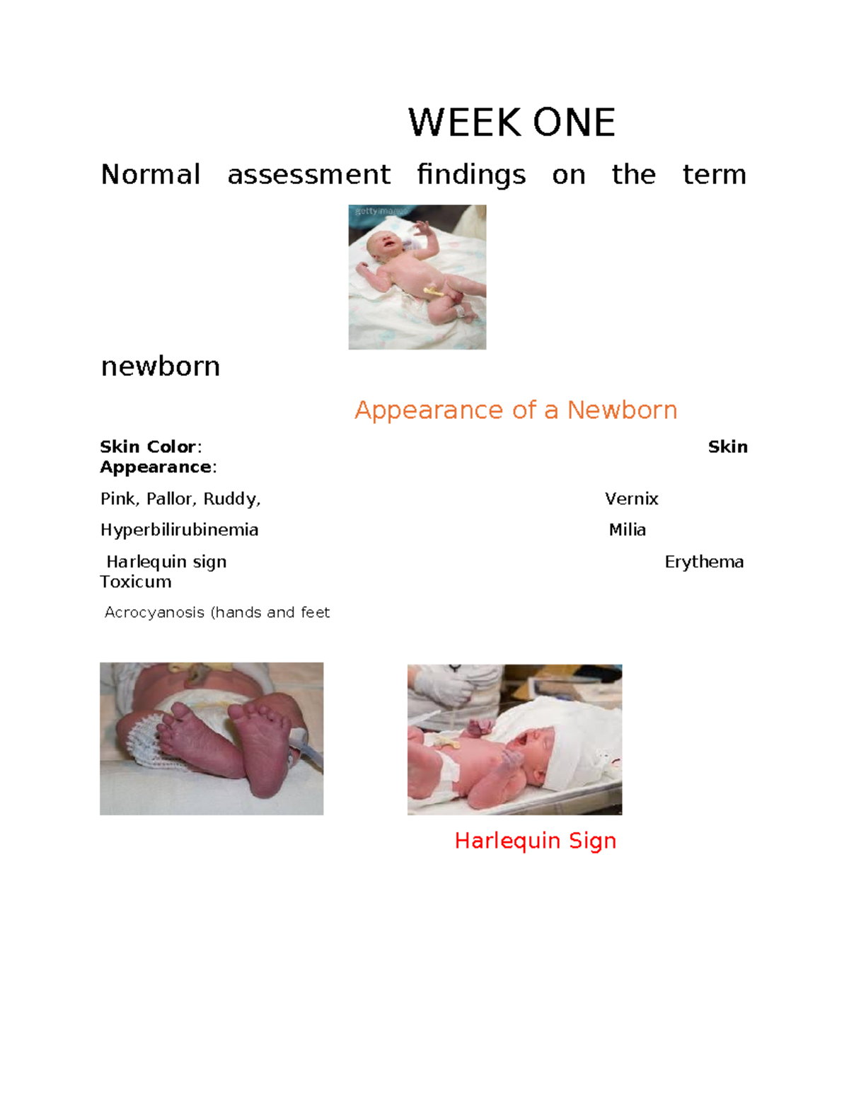 Week 1 102 - Pediatric & OB: Newborn Assessment Findings - Studocu