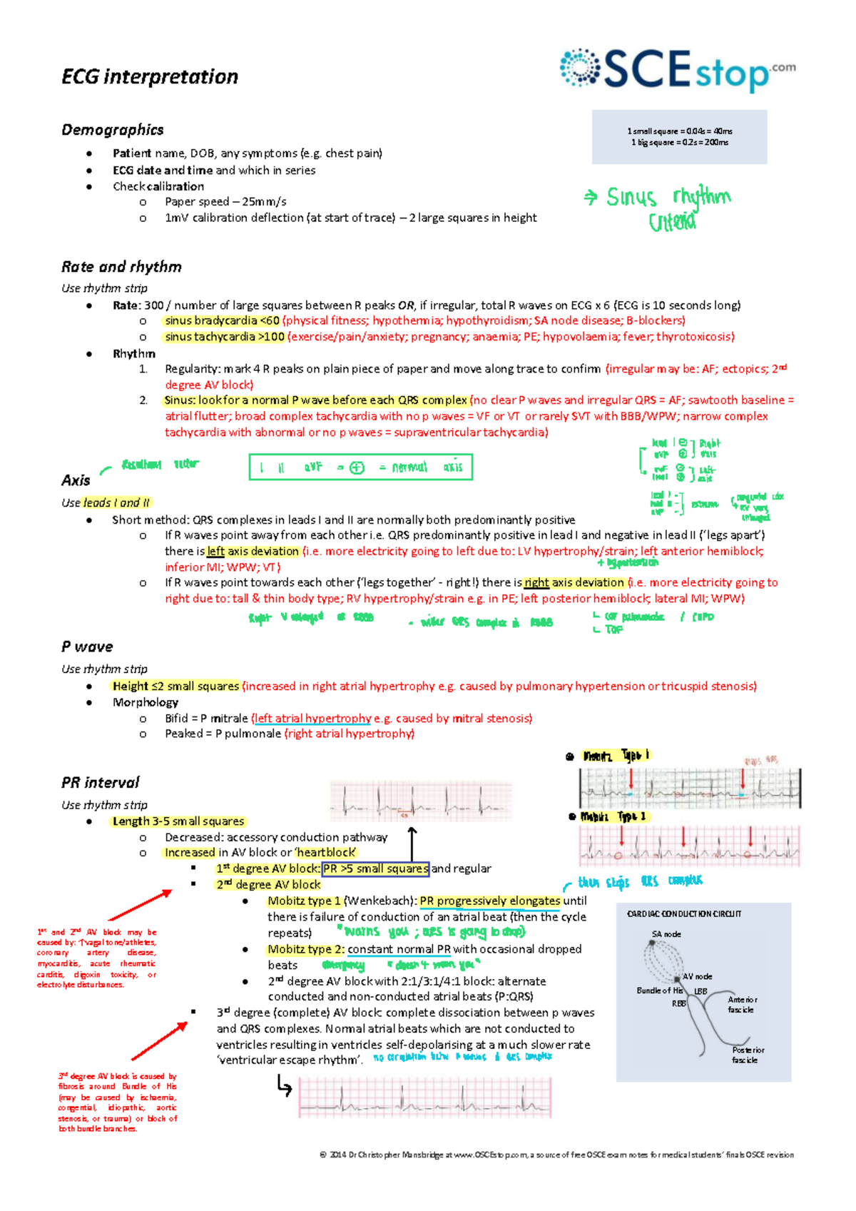 ECG Interpretation Notes for Medical Finals (OSCE Revision) - Studocu