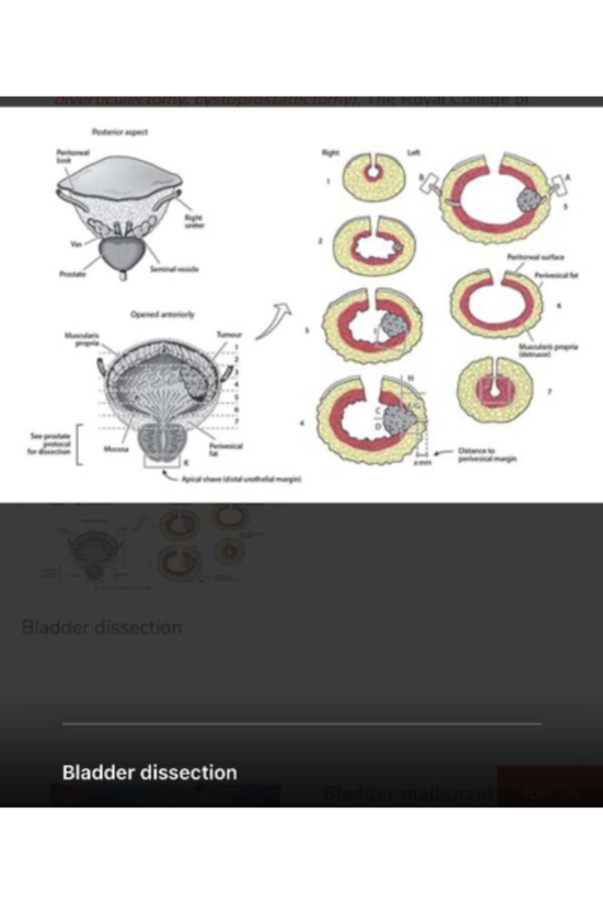 Bladder Gross Examination Protocol - 05 B 1 5 - Studocu