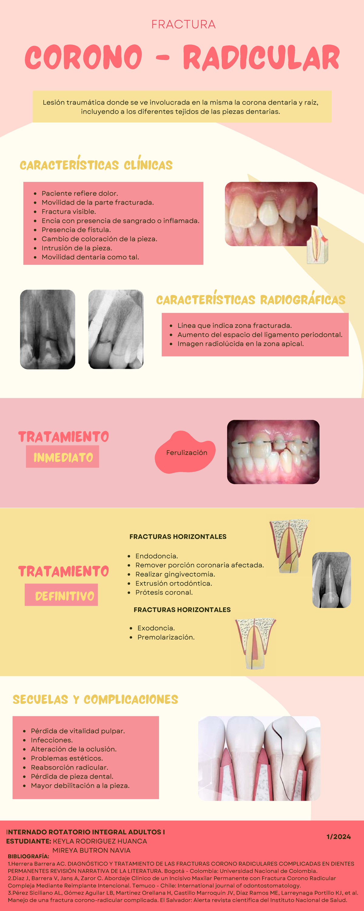 Fractura corono radicular: características clínicas y tratamiento ...