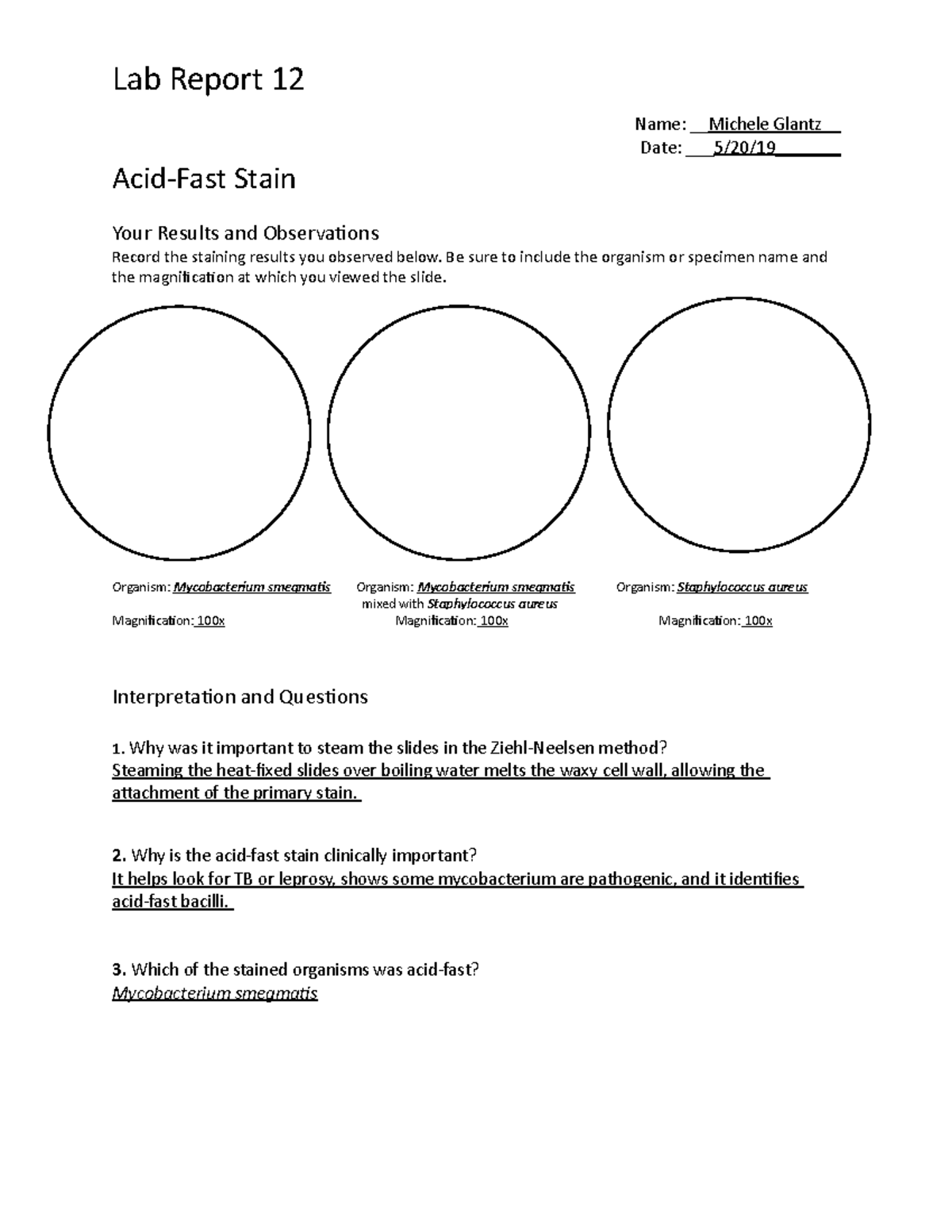 Lab Exercise 12: Acid-Fast Stain Observations and Conclusions - Studocu