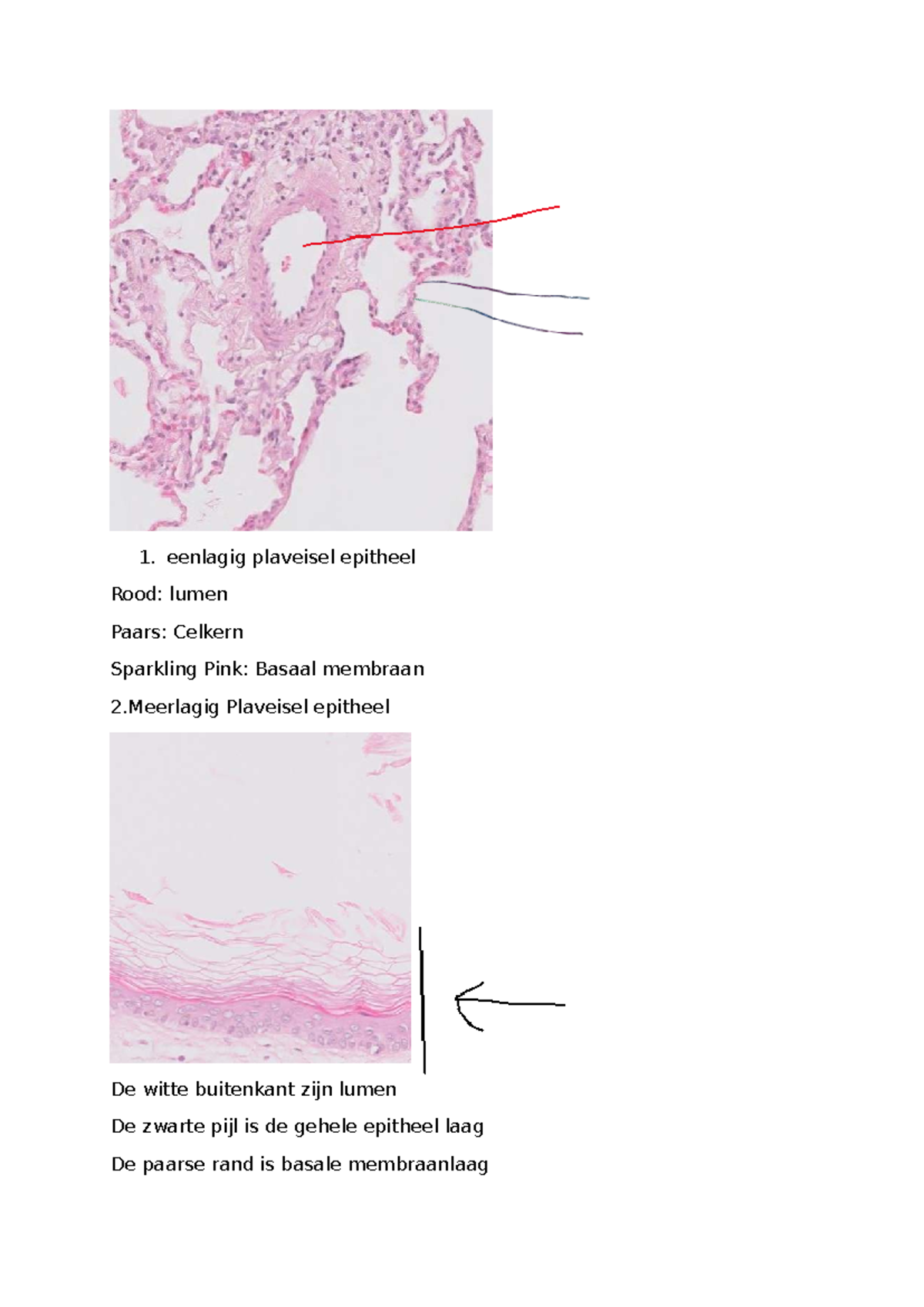 Epiteel Weefsel Analyse en Kenmerken - Biologie PT 05 Opdrachten ...