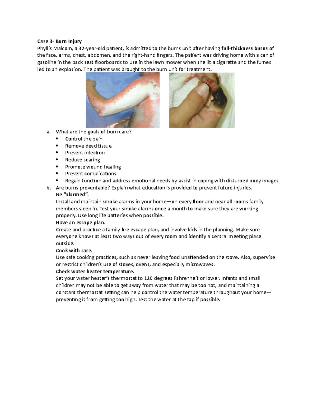 CASE Study 3-Integumentary - Case 3- Burn Injury Phyllis Malcom, a 32 ...
