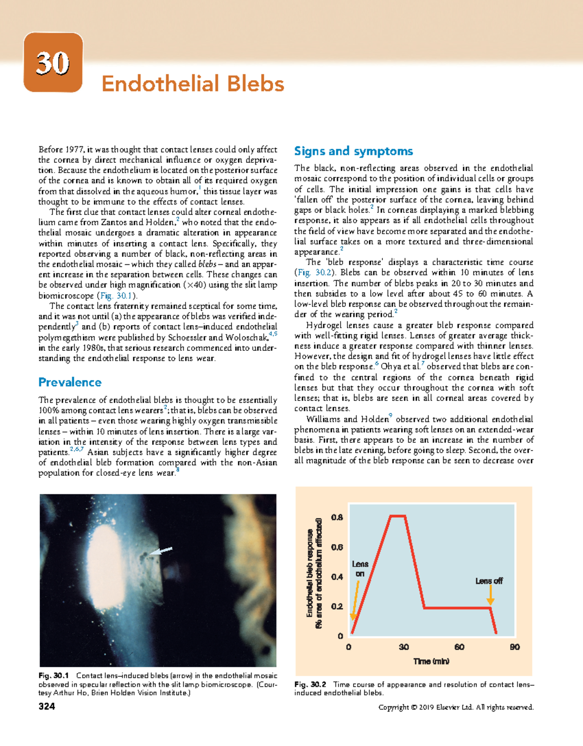 3030 Endothelial Blebs in Contact Lens Wear: Complications & Findings ...