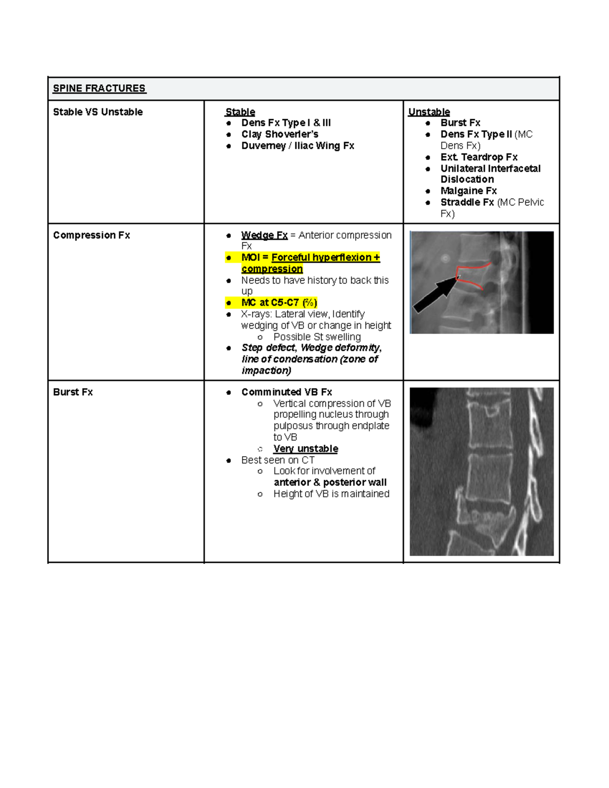 RAD IIB Study Guide: Spine and Pelvic Fractures Overview - Studocu