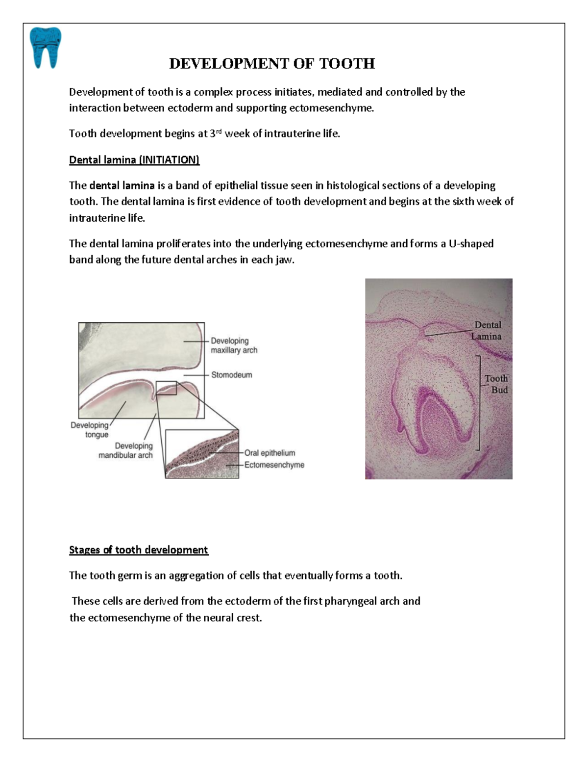 Dch-notebook-development-of-tooth - DEVELOPMENT OF TOOTH Development of ...