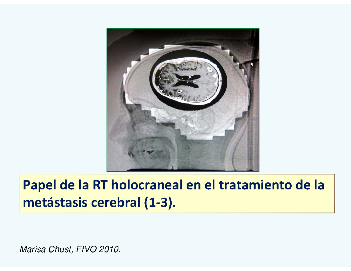 Radioterapia Holocraneal en Metástasis Cerebrales: Estudio FIVO 2010 ...