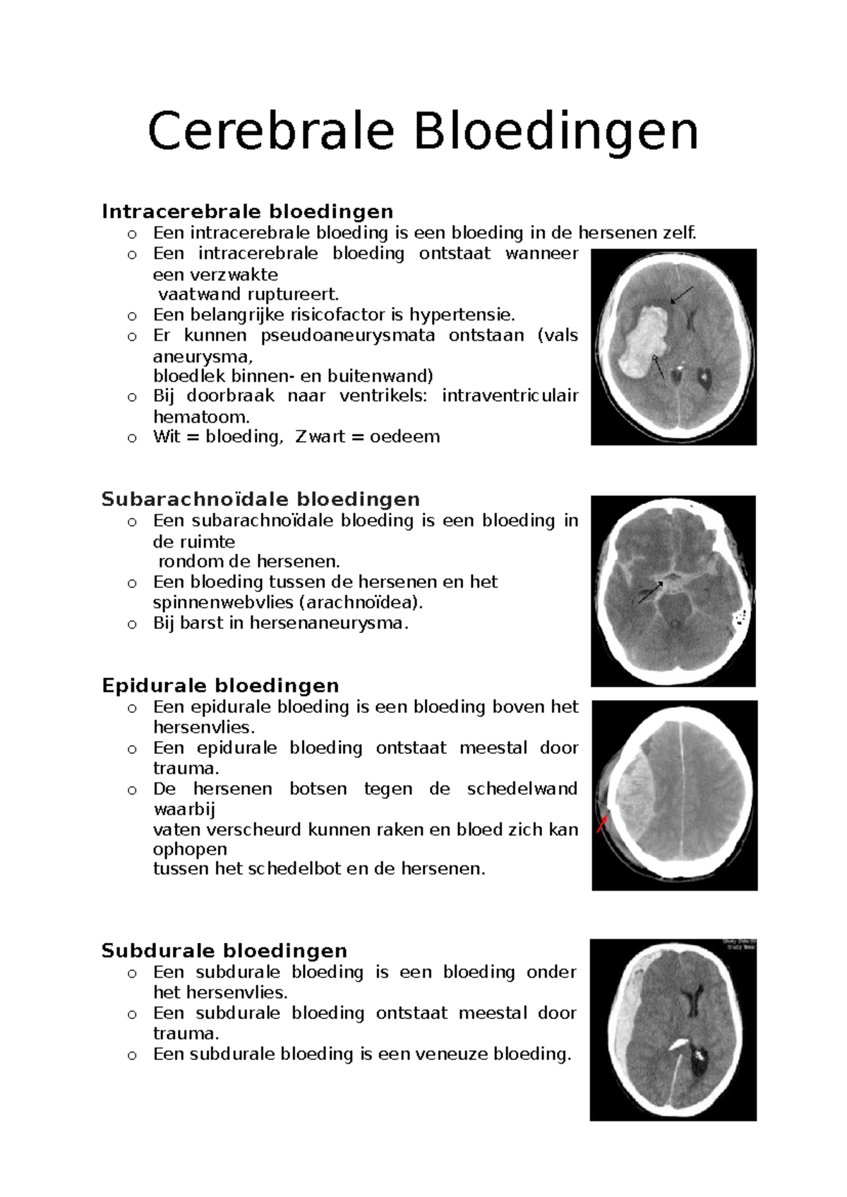 Cerebrale Bloedingen, Mammacarcinoom en Urogenitalis Verstoringen ...