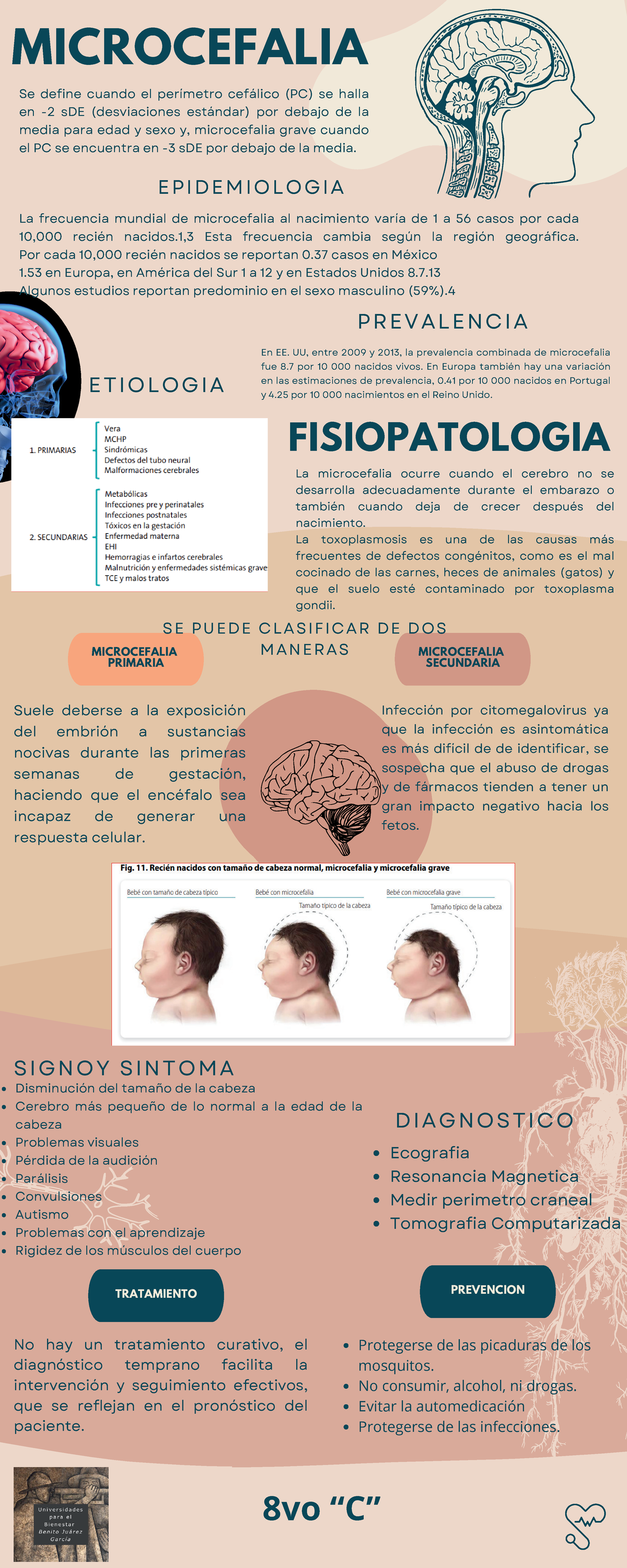 Microcefalia: Diagnóstico, Tratamiento y Epidemiología (8vo “C”) - Studocu