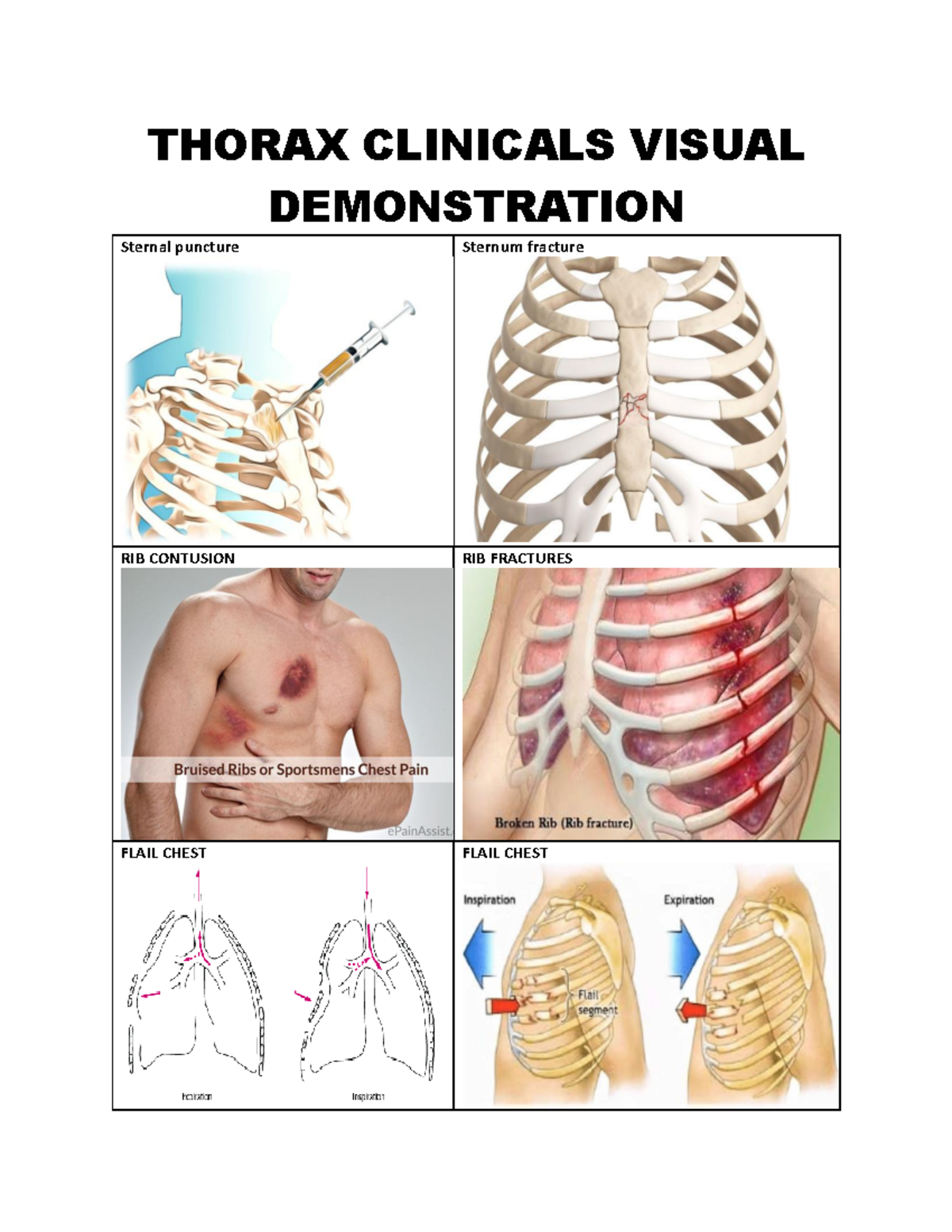 Clinical Demonstration of Thoracic Procedures: Sternal Puncture & More ...