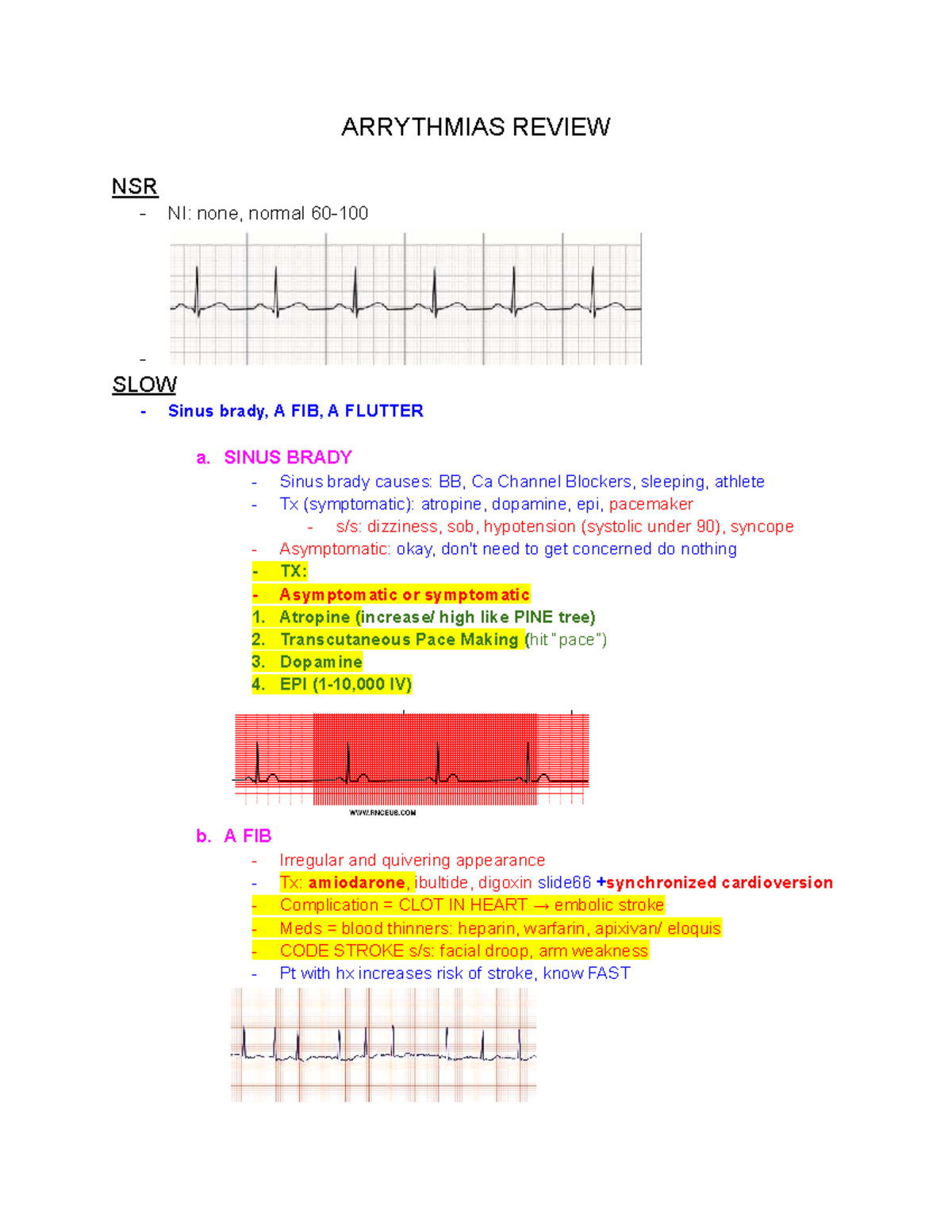 MedSurg Quiz Review: Arrhythmias and Cardiac Emergencies - Studocu