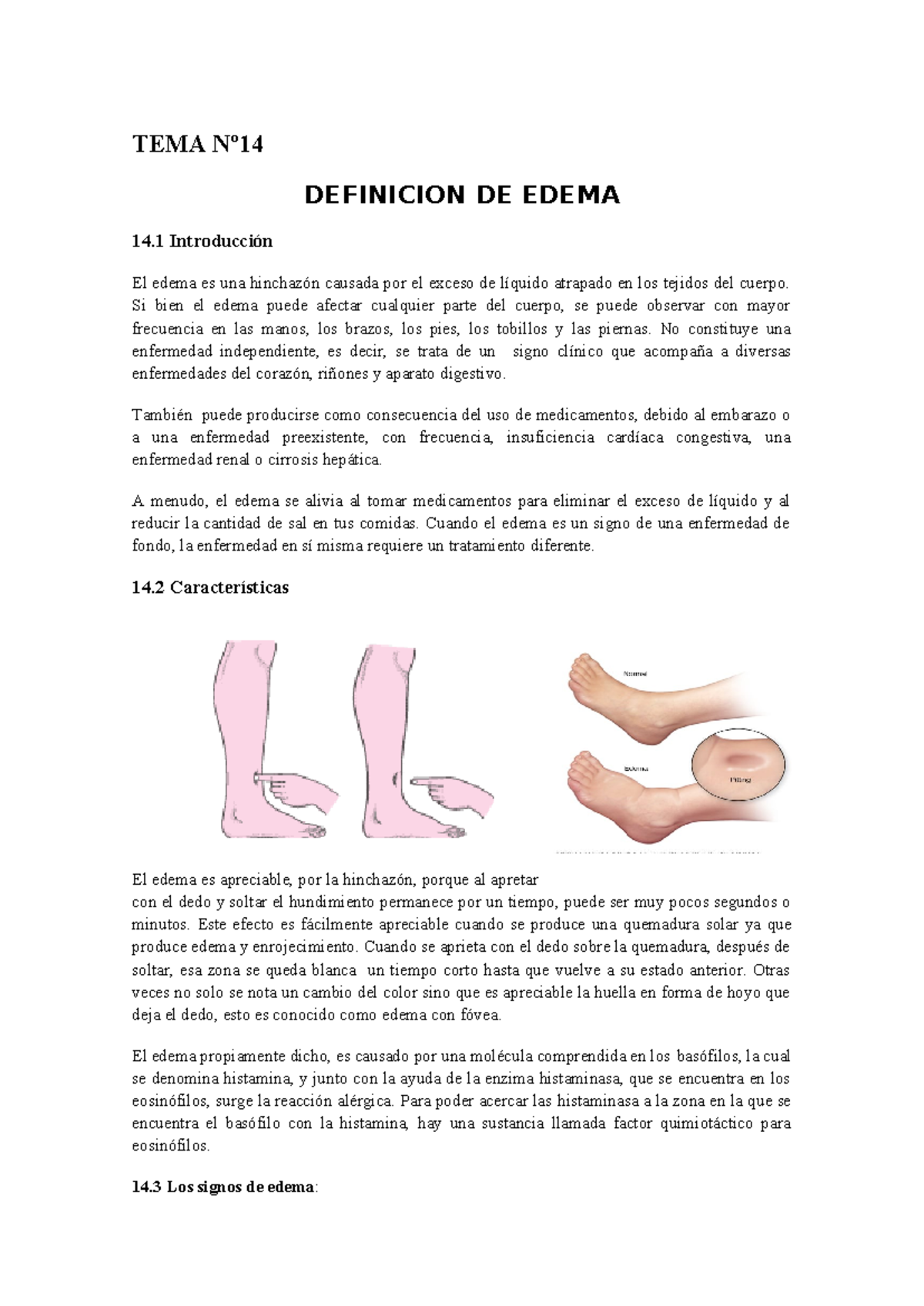 TEMA Nº14: Edema - Definición, Causas y Tratamientos - Studocu