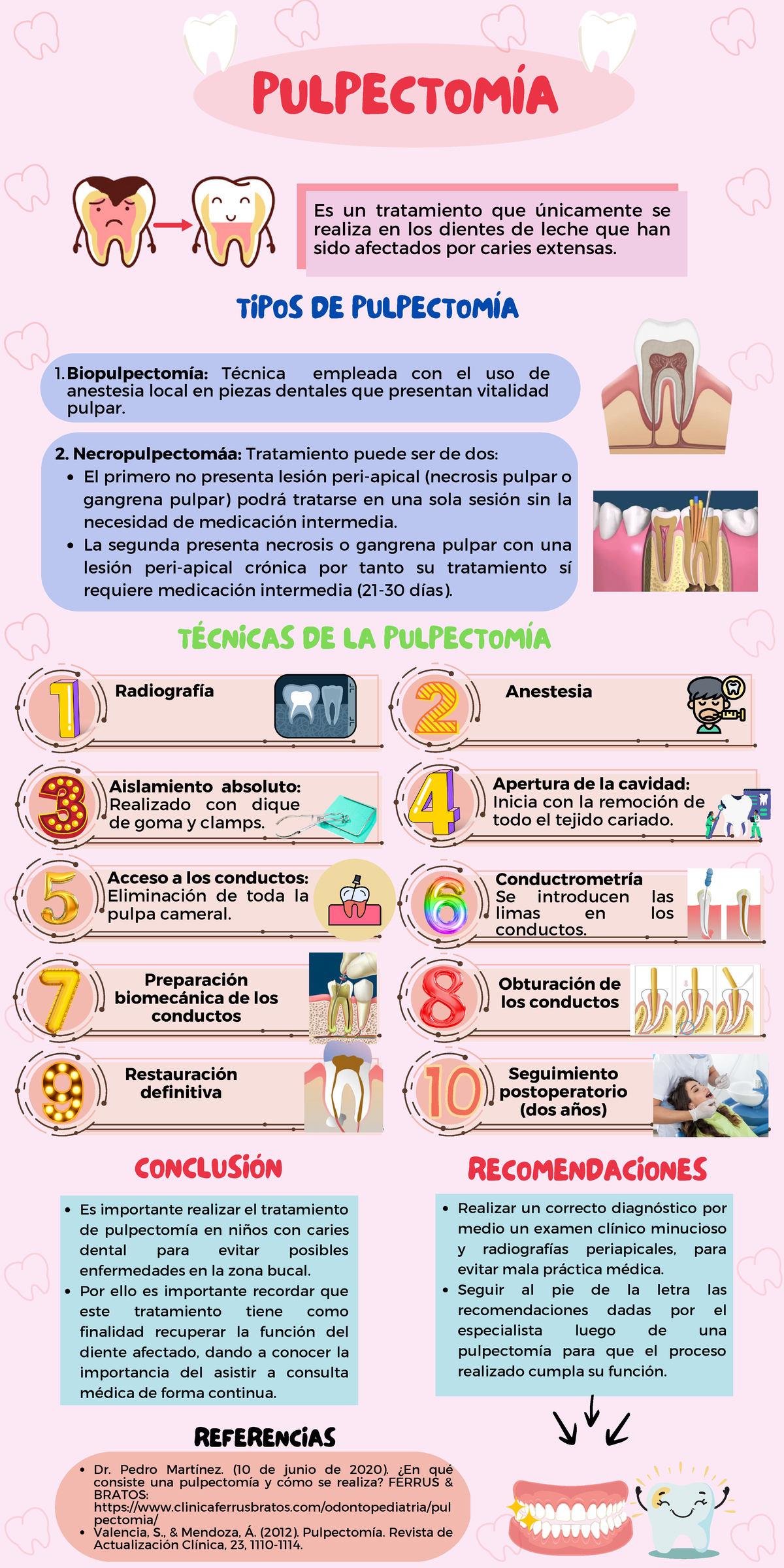 Infografía sobre Técnicas de Pulpectomía en Odontopediatría - Studocu