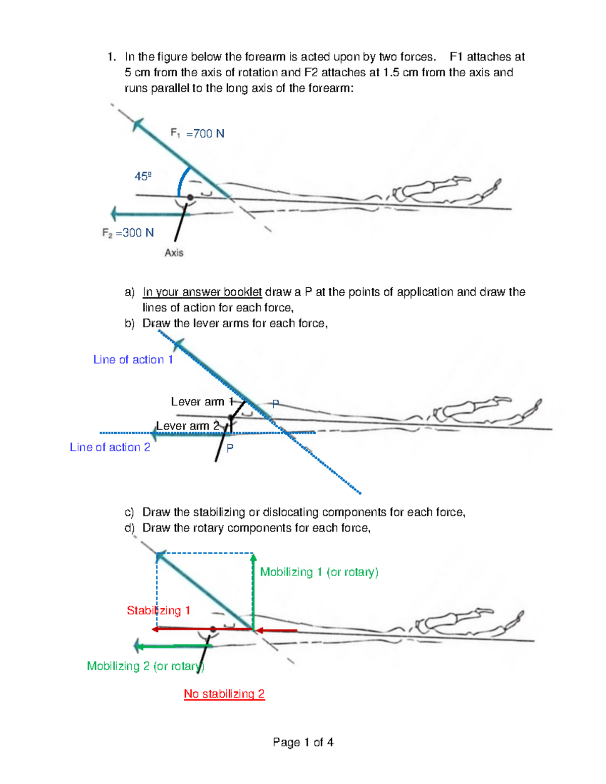 Joint loading examples - In the figure below the forearm is acted upon ...