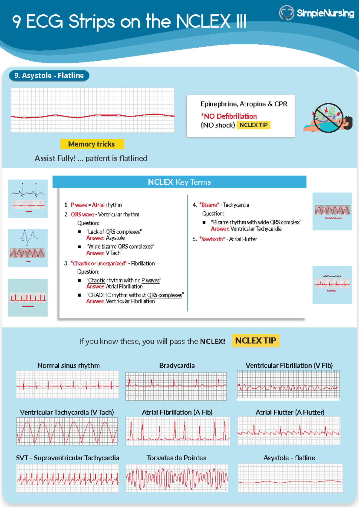 9 ECG Strips for NCLEX: Asystole, V Tach, and Key Tips - Studocu