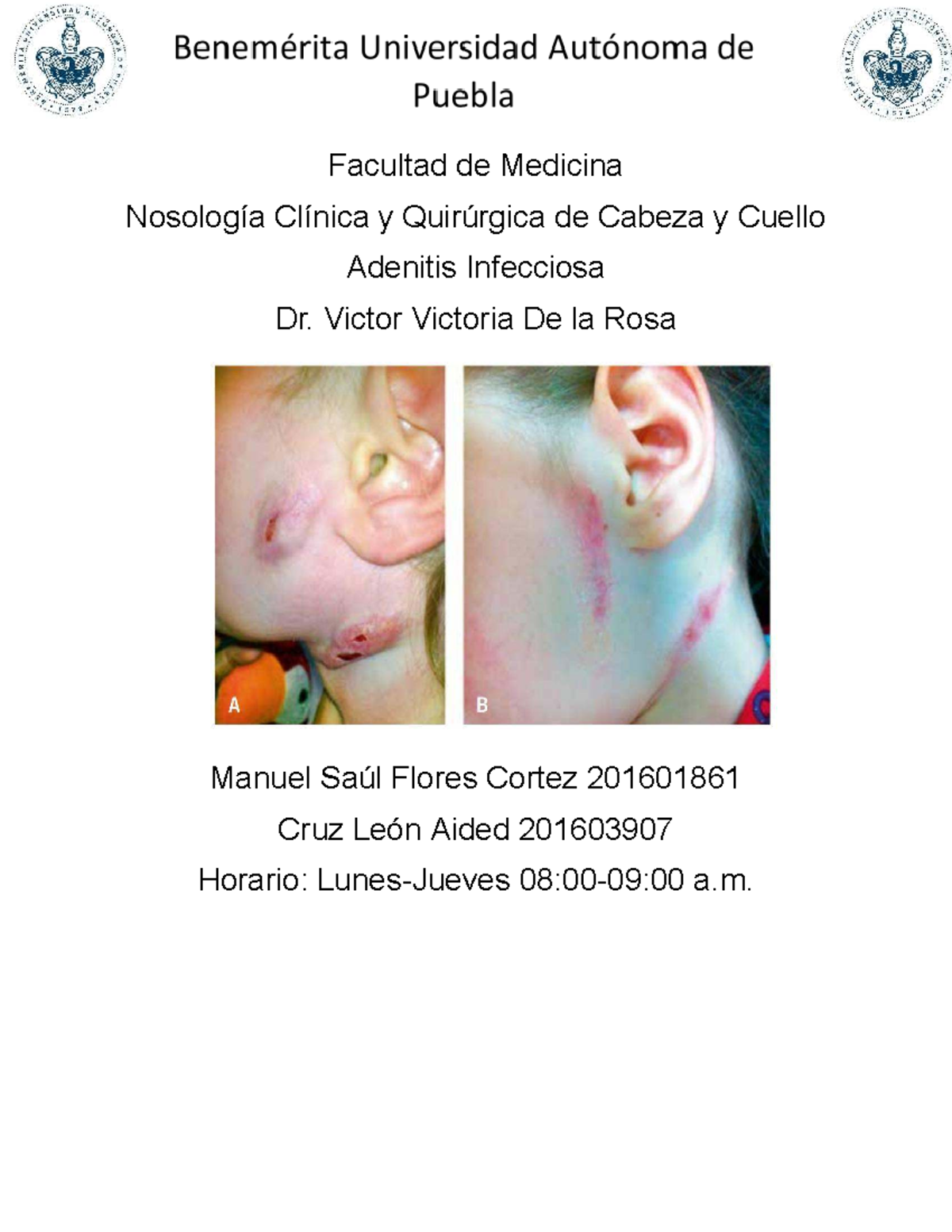 Resumen de Adenitis Infecciosa - Facultad de Medicina 2016 - Studocu