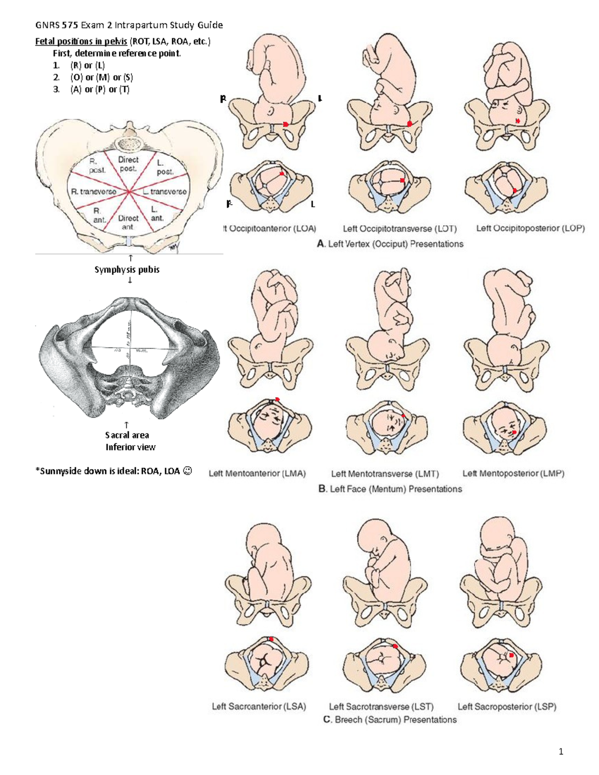 GNRS 575 - Exam 2 Intrapartum Study Guide - Fetal positions in pelvis ...