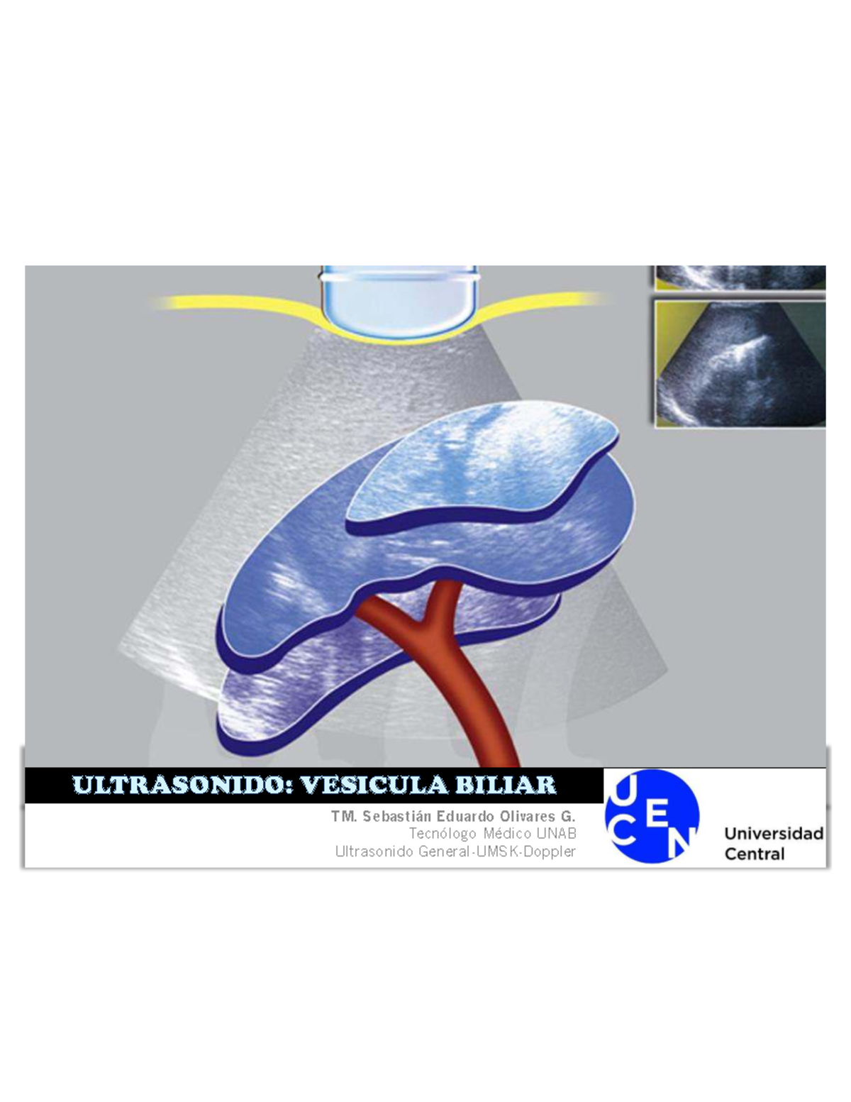 ULTRASONIDO: EXPLORACIÓN Y ANATOMÍA DE LA VESÍCULA BILIAR TM - Studocu