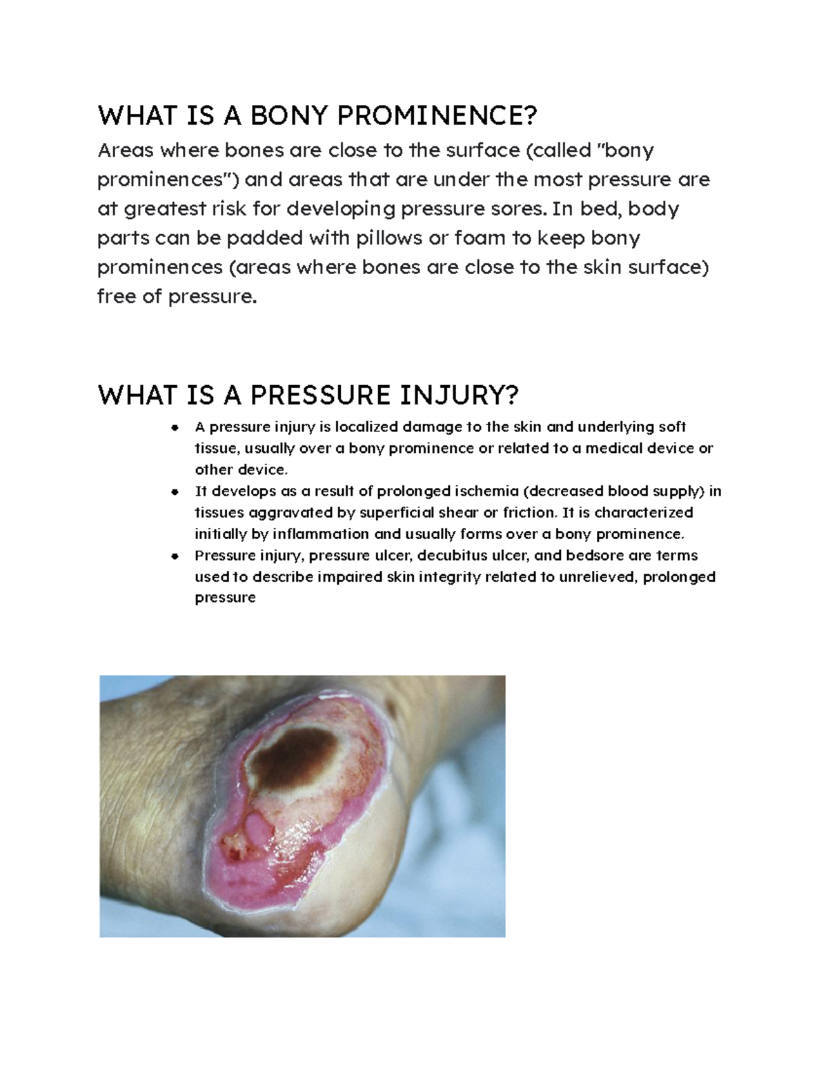 Nursing Focus on Bony Prominences: Pressure Injury Care Strategies ...
