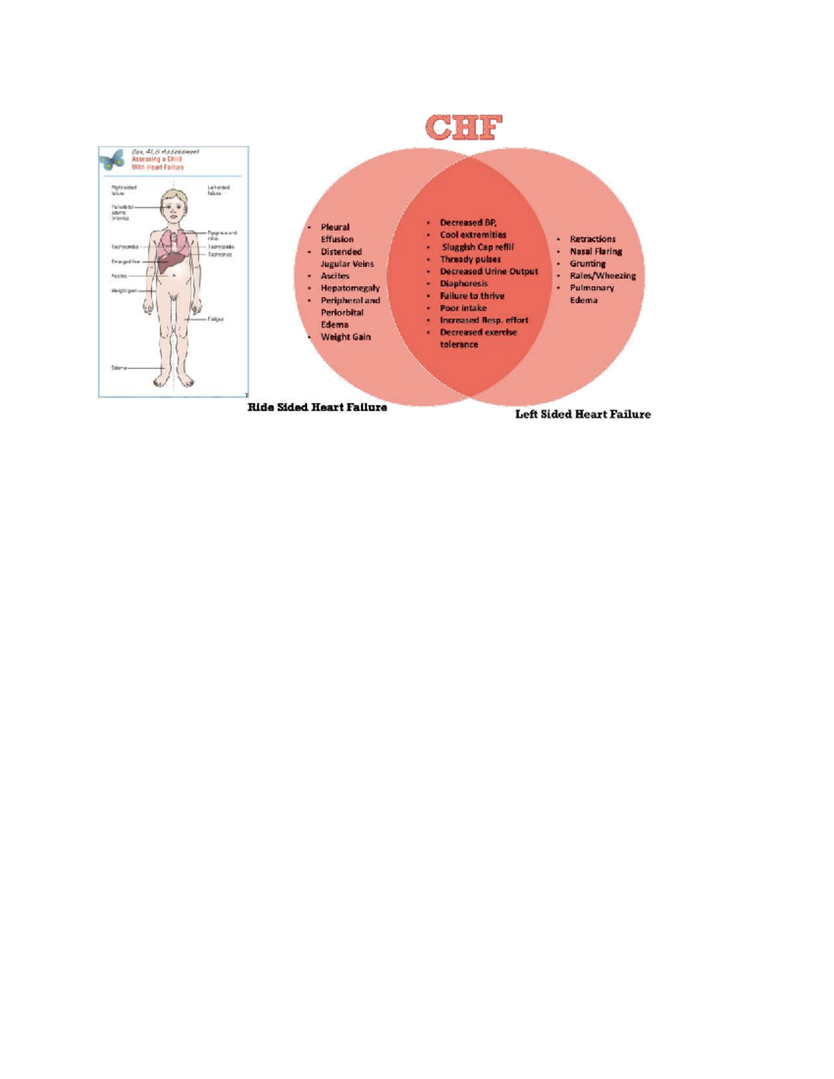 CHF Box 41.6 Assessment: Evaluating Pediatric Heart Failure - Studocu