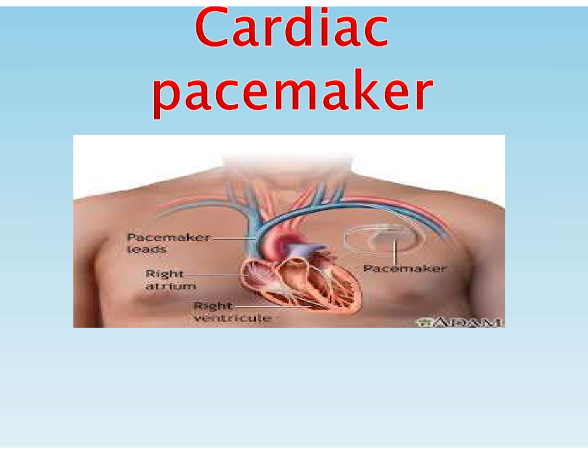 Outline: Cardiac Pacemaker Types, Functions, and Indications (MED 101 ...