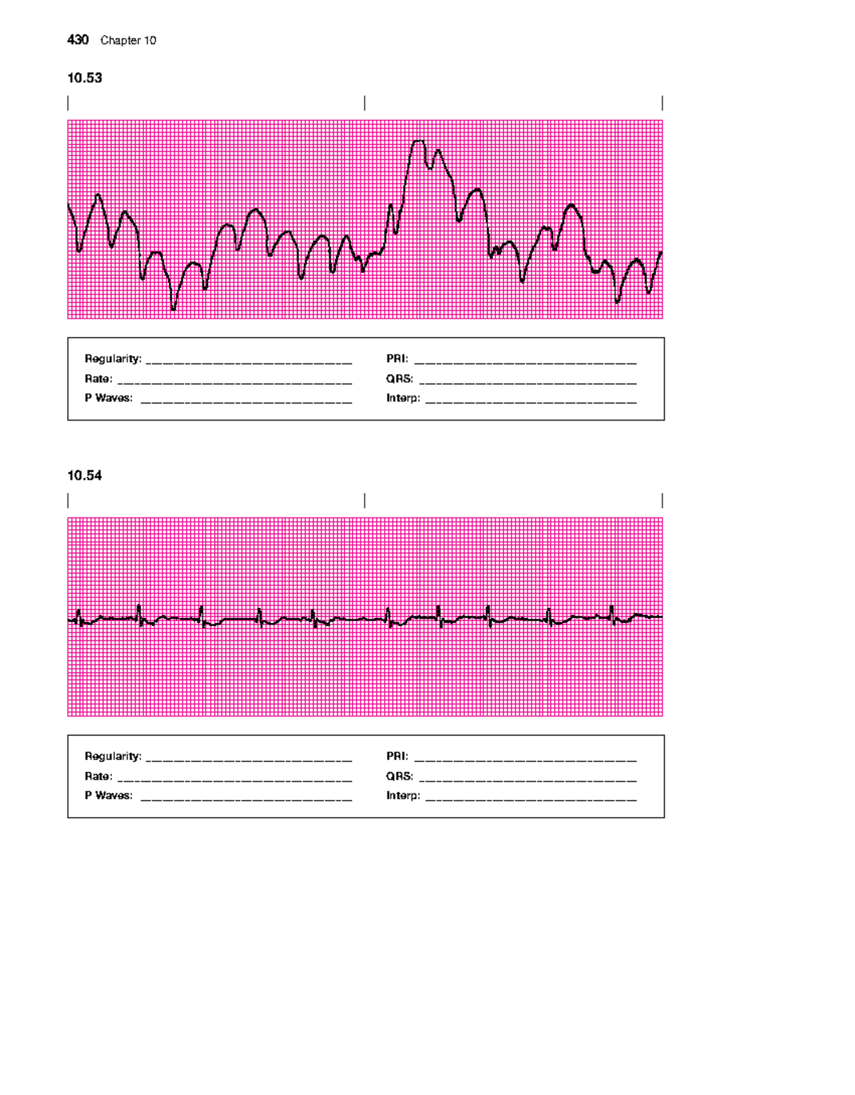 430 Chapter 10: EKG Interpretation & Arrhythmias Final Challenge - Studocu