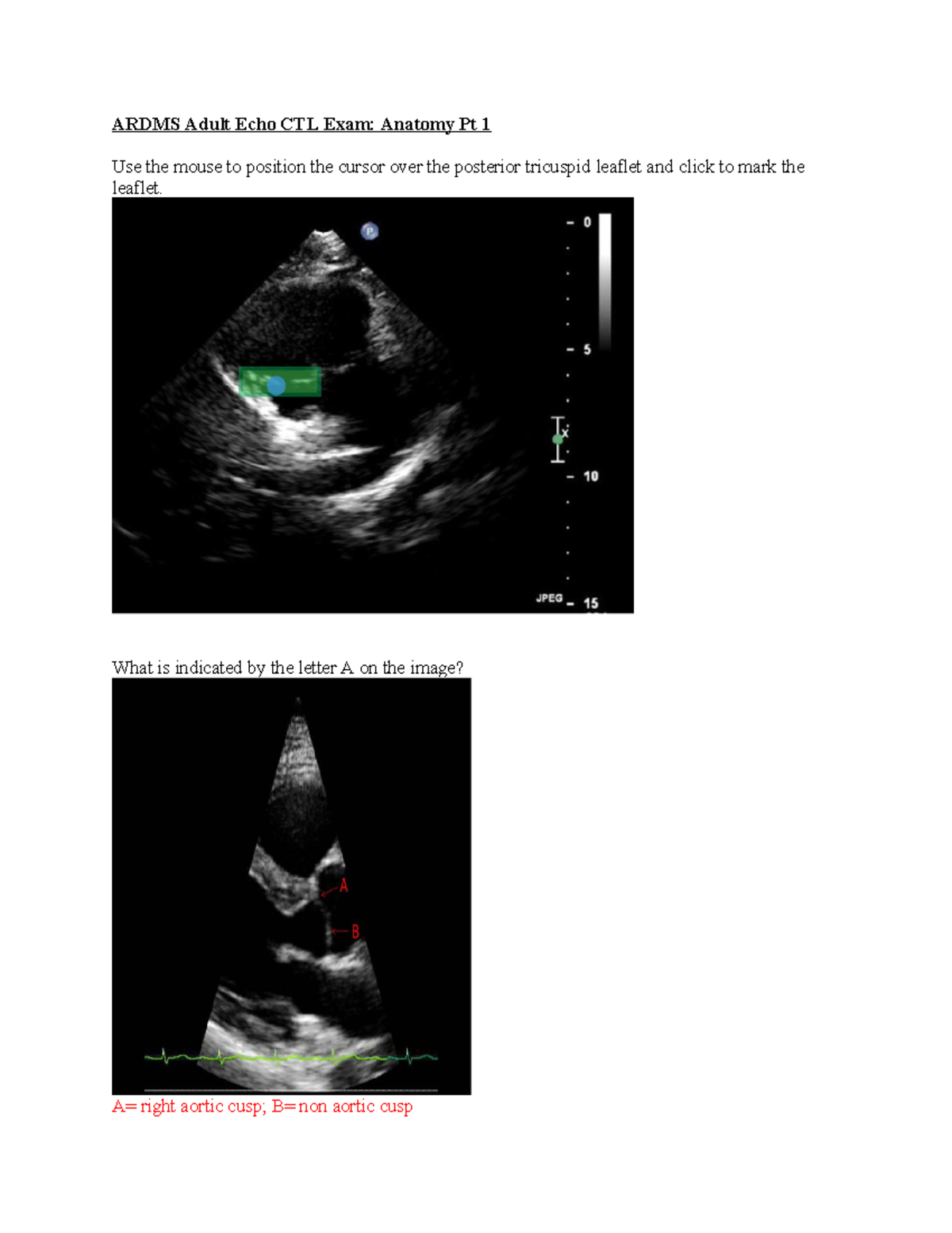 ARDMS Adult Echo CTL Exam: Cardiovascular Anatomy Review Pt 1 - Studocu