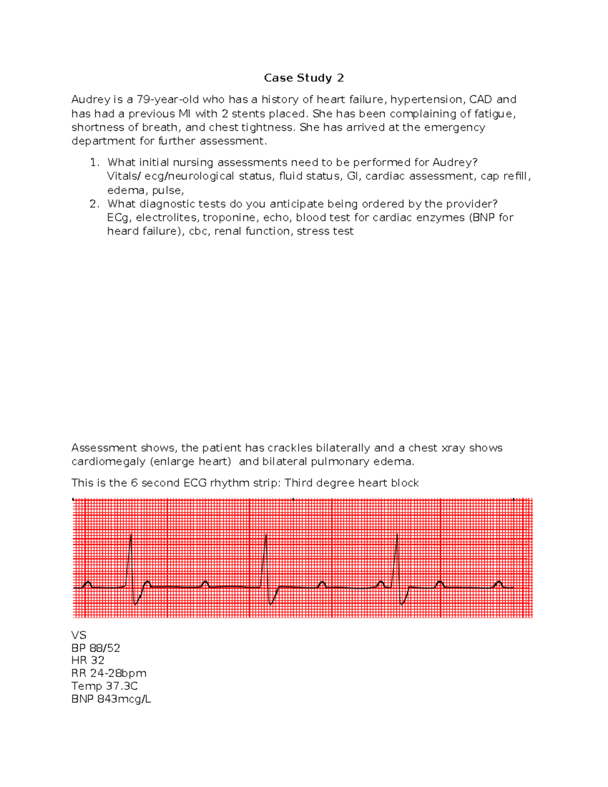 Cardiac case study 2: Nursing assessments and diagnostic tests for ...