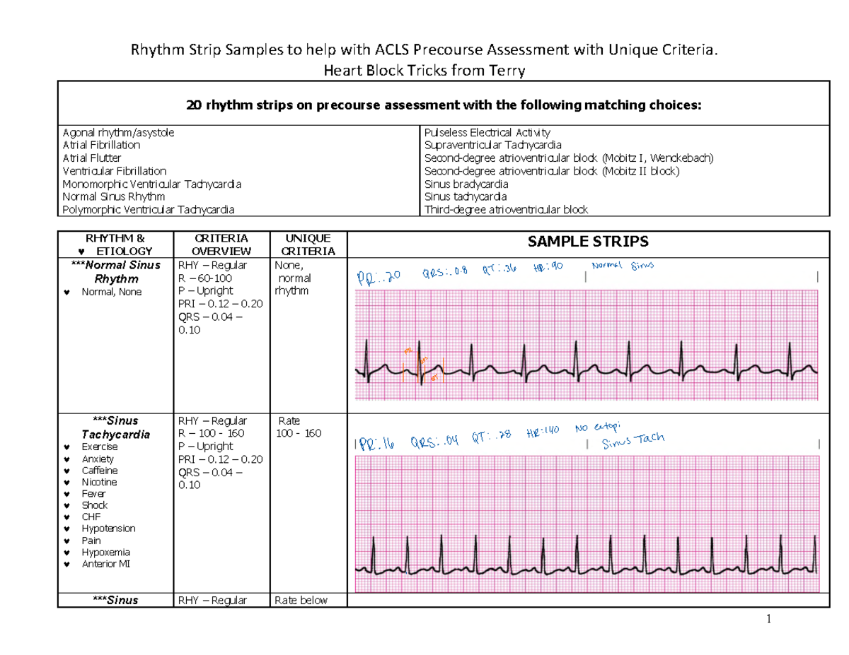 EKG interpretation - guide - Heart Block Tricks from Terry 20 rhythm ...