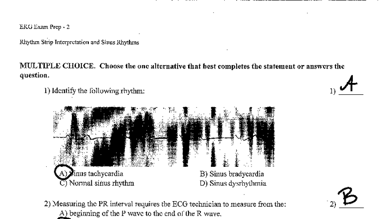 EKG Exam Prep 2: Rhythm Strip Interpretation & Sinus Rhythms MCQ - Studocu