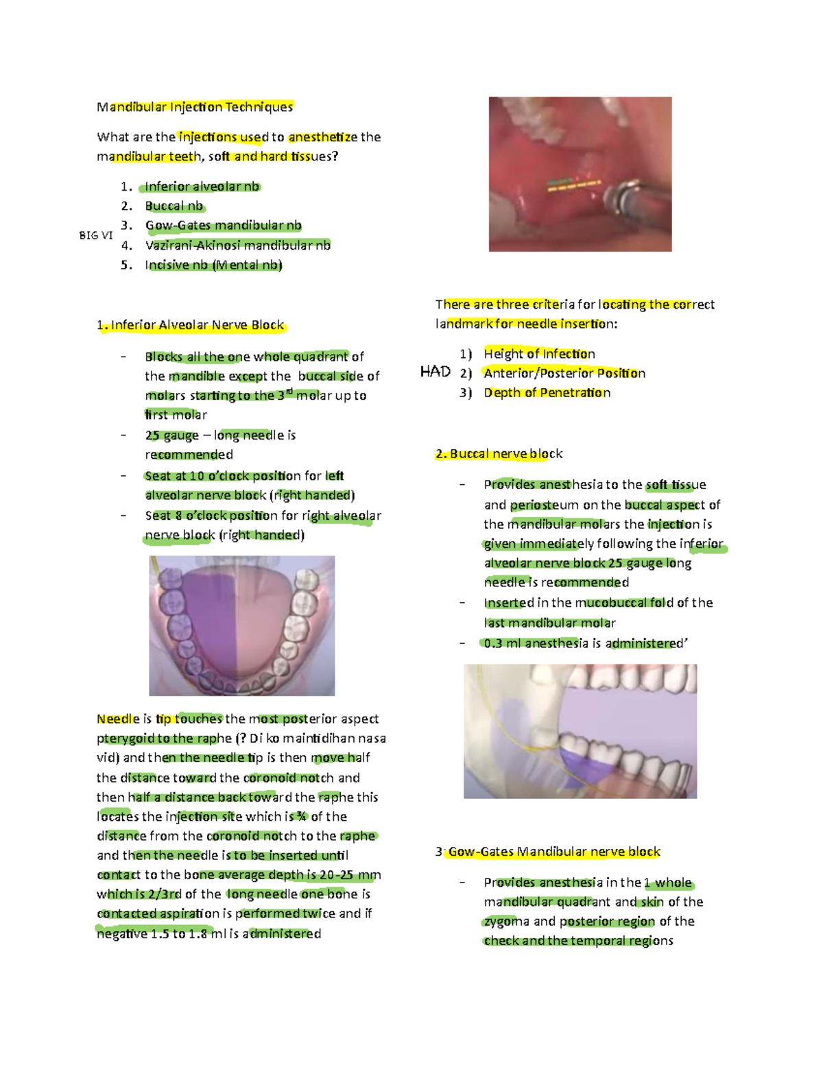 Mandibular Injection Techniques: Anesthesia Methods for Dental ...