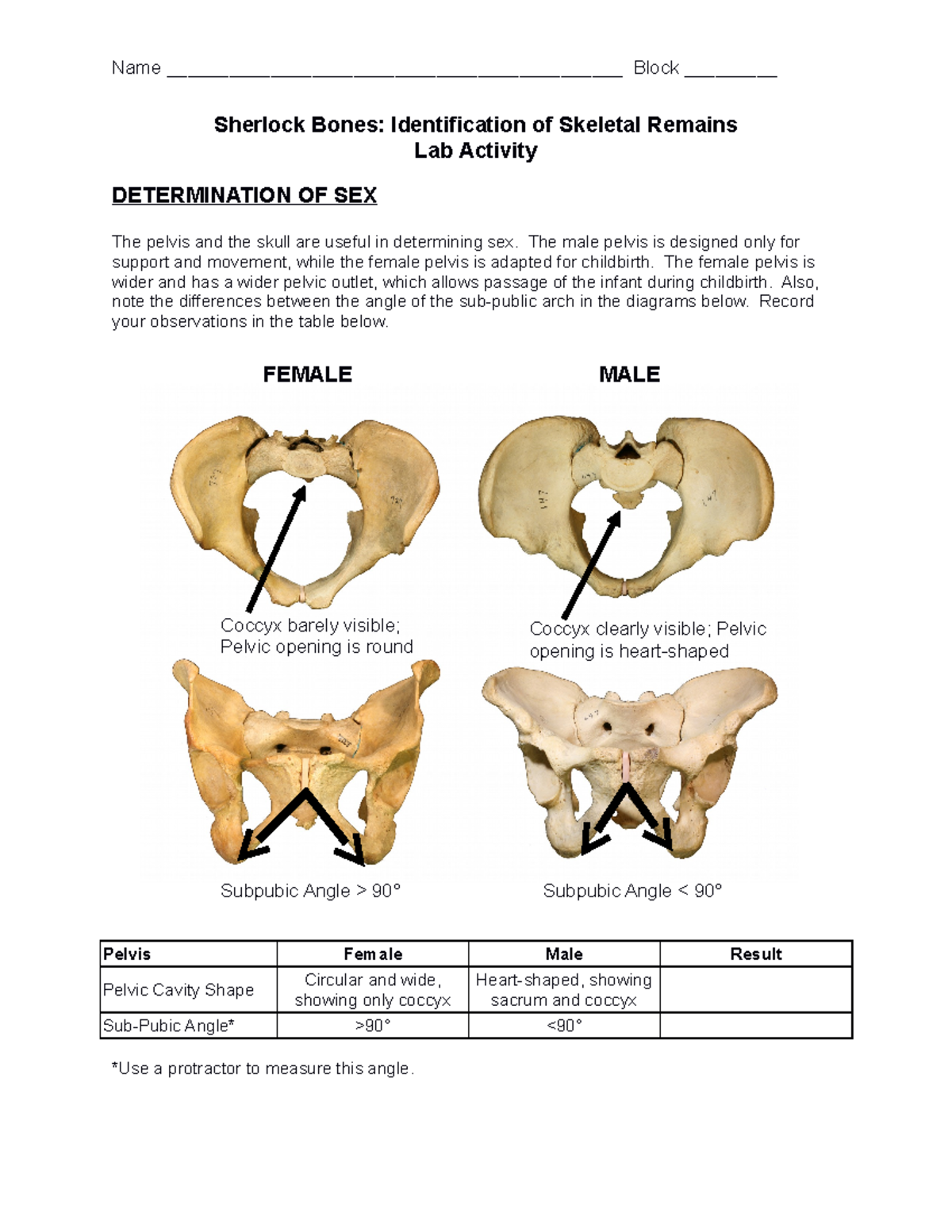 Skeleton lab note - Subpubic Angle > 90° Subpubic Angle