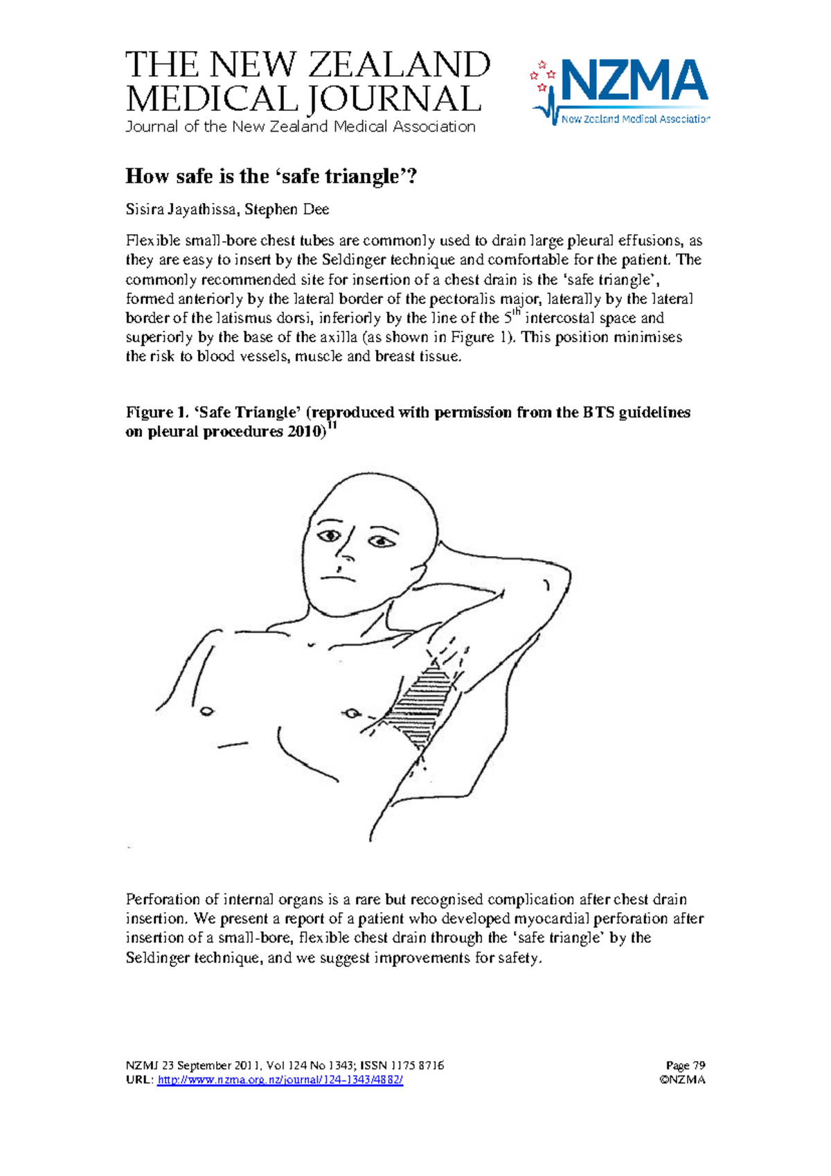 NZMJ 23 Sept 2011: Safety of Chest Drain Insertion in the 'Safe ...