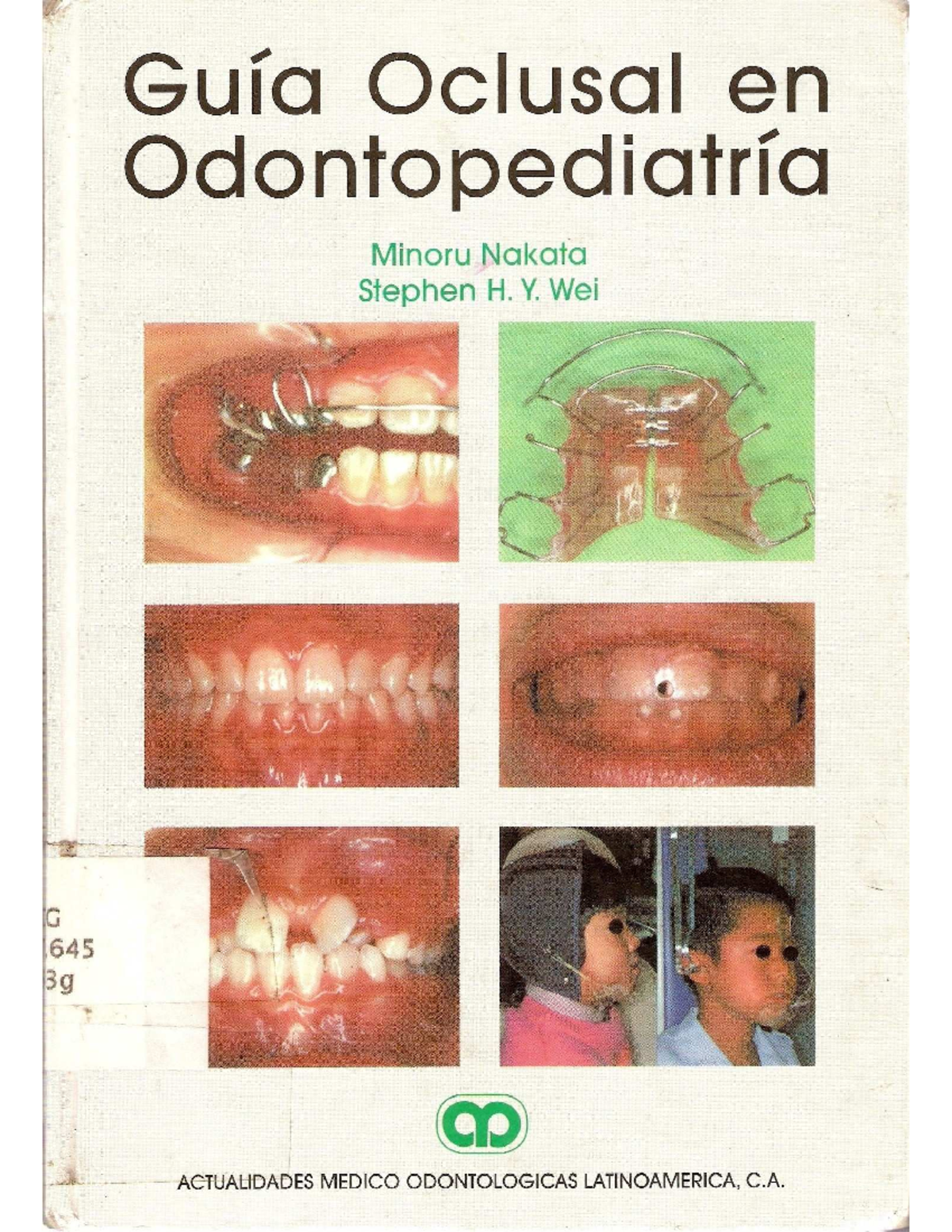 Guia oclusal em odontopediatria - Guía Oclusal en Odontopediatría ...