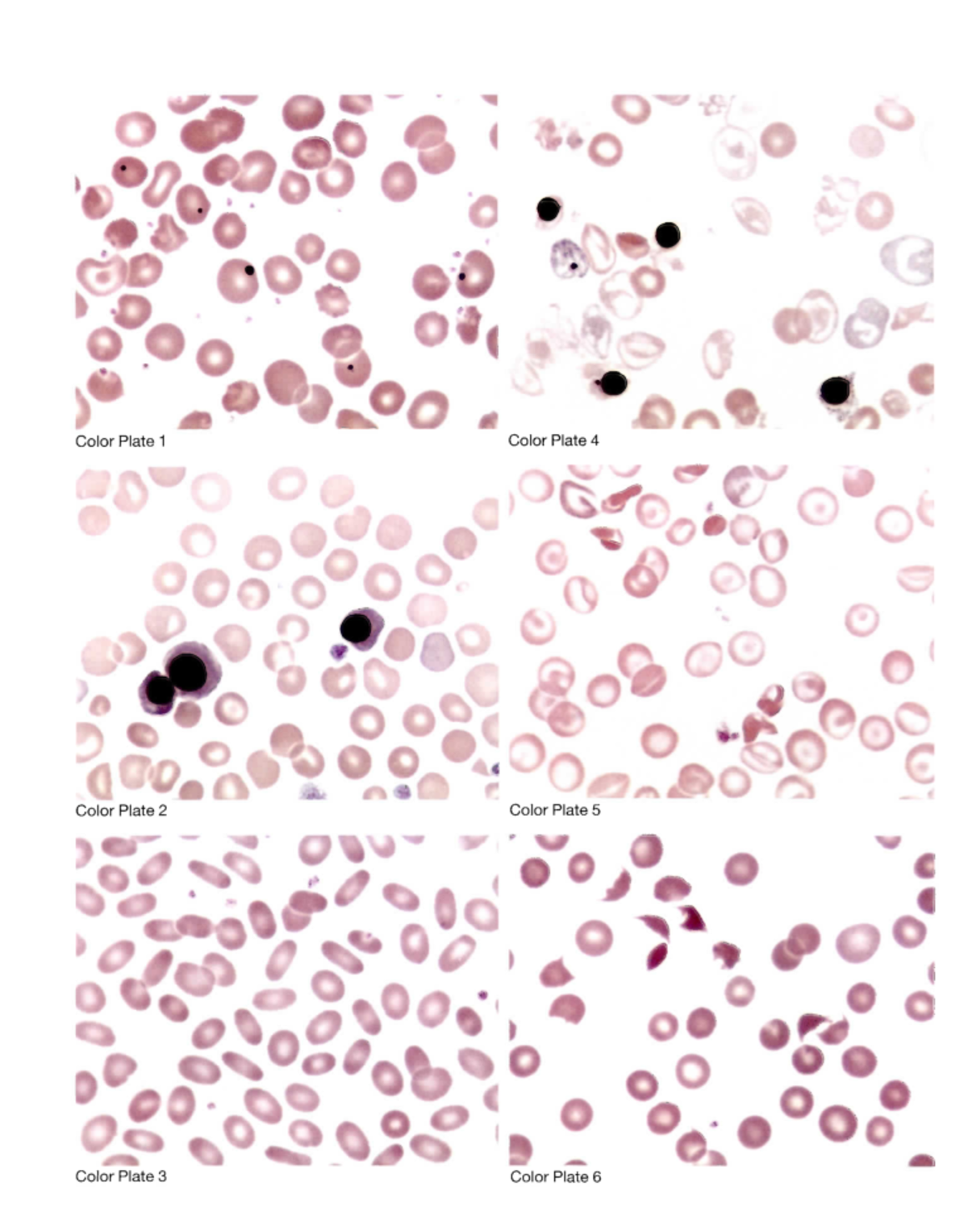 Color Plates (1-60) for Immunoglobulin & DNA Analysis - Studocu
