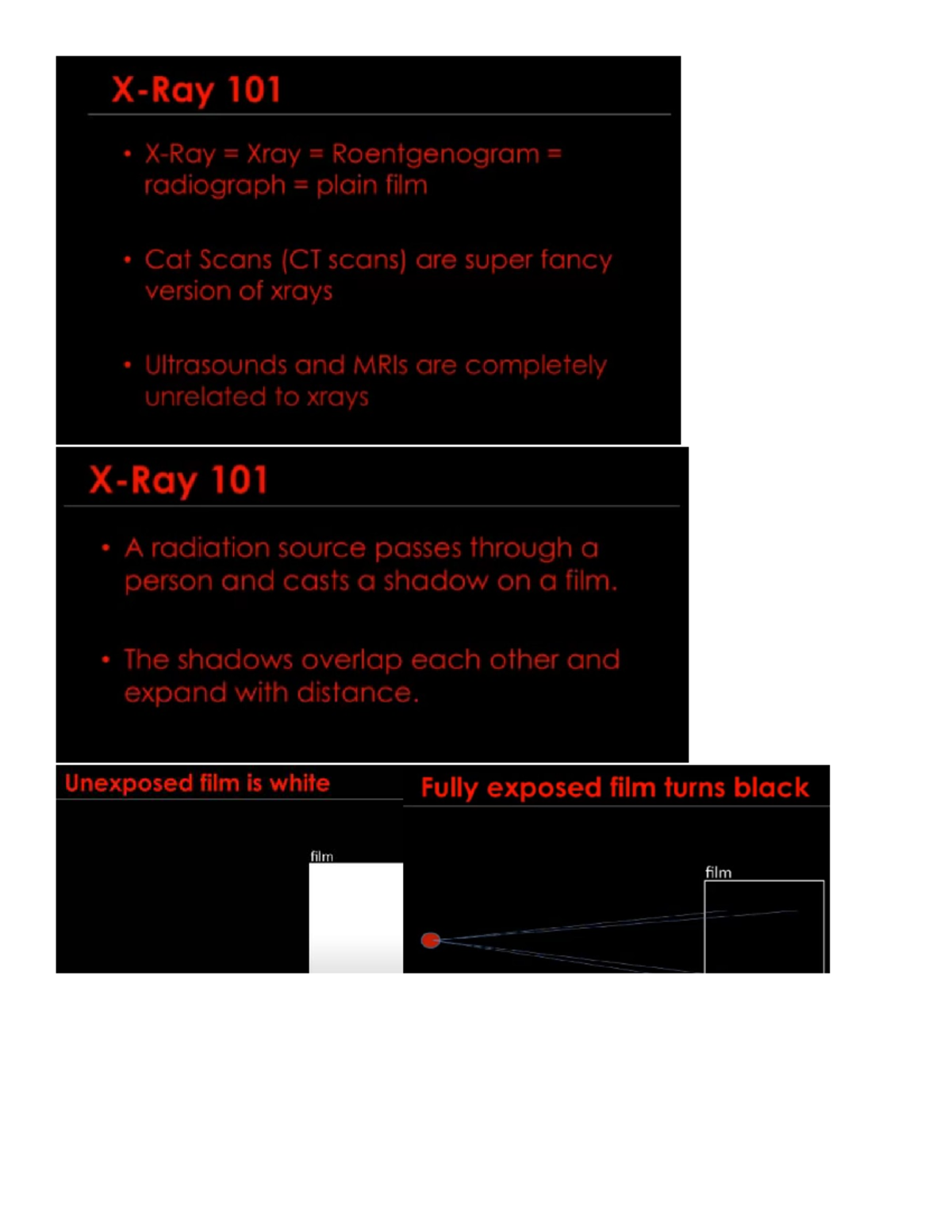 Xray 101: Lecture Notes on Radiographs & Chest Interpretation - Studocu