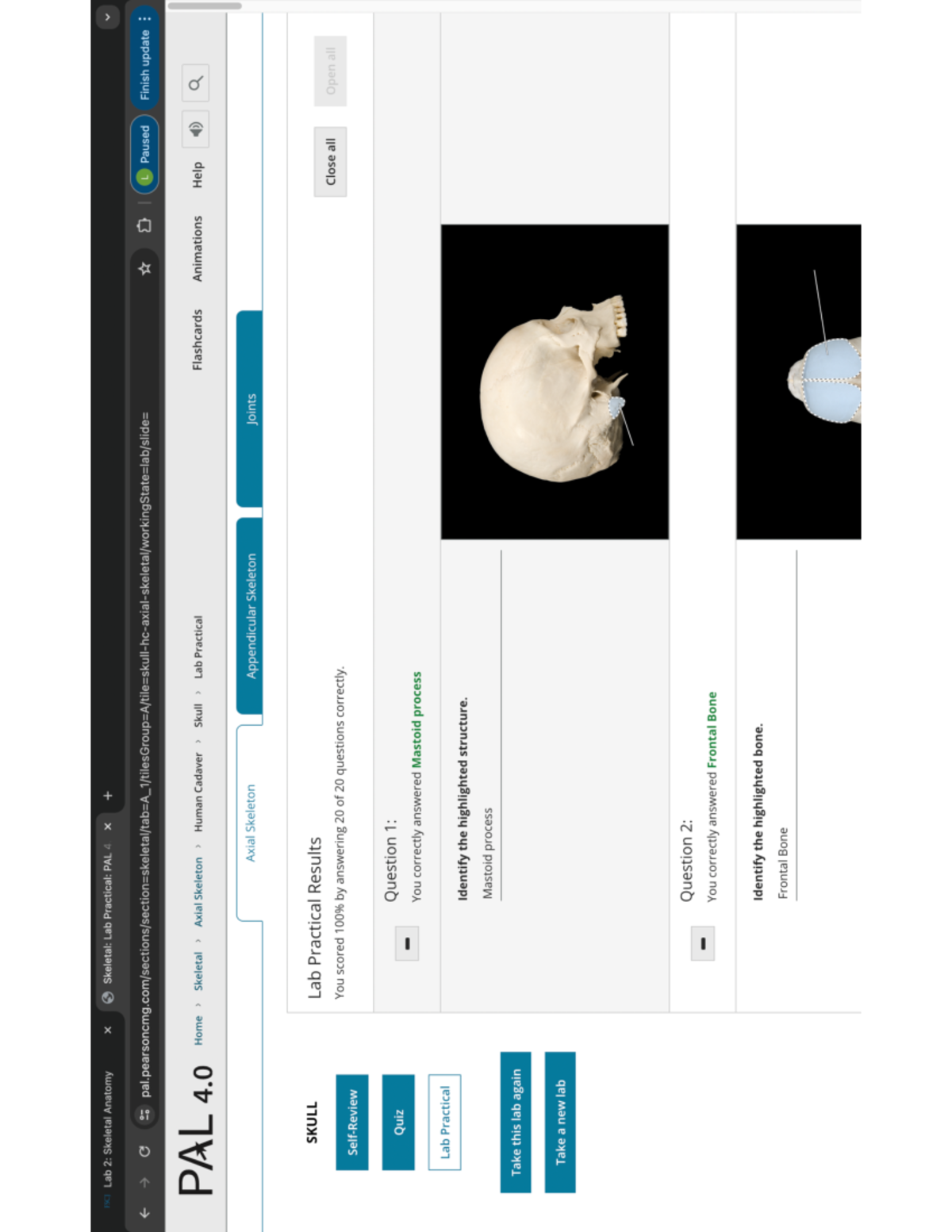 A&P 1 - Lab 2: Skeletal Anatomy Practical Quiz Results - Studocu