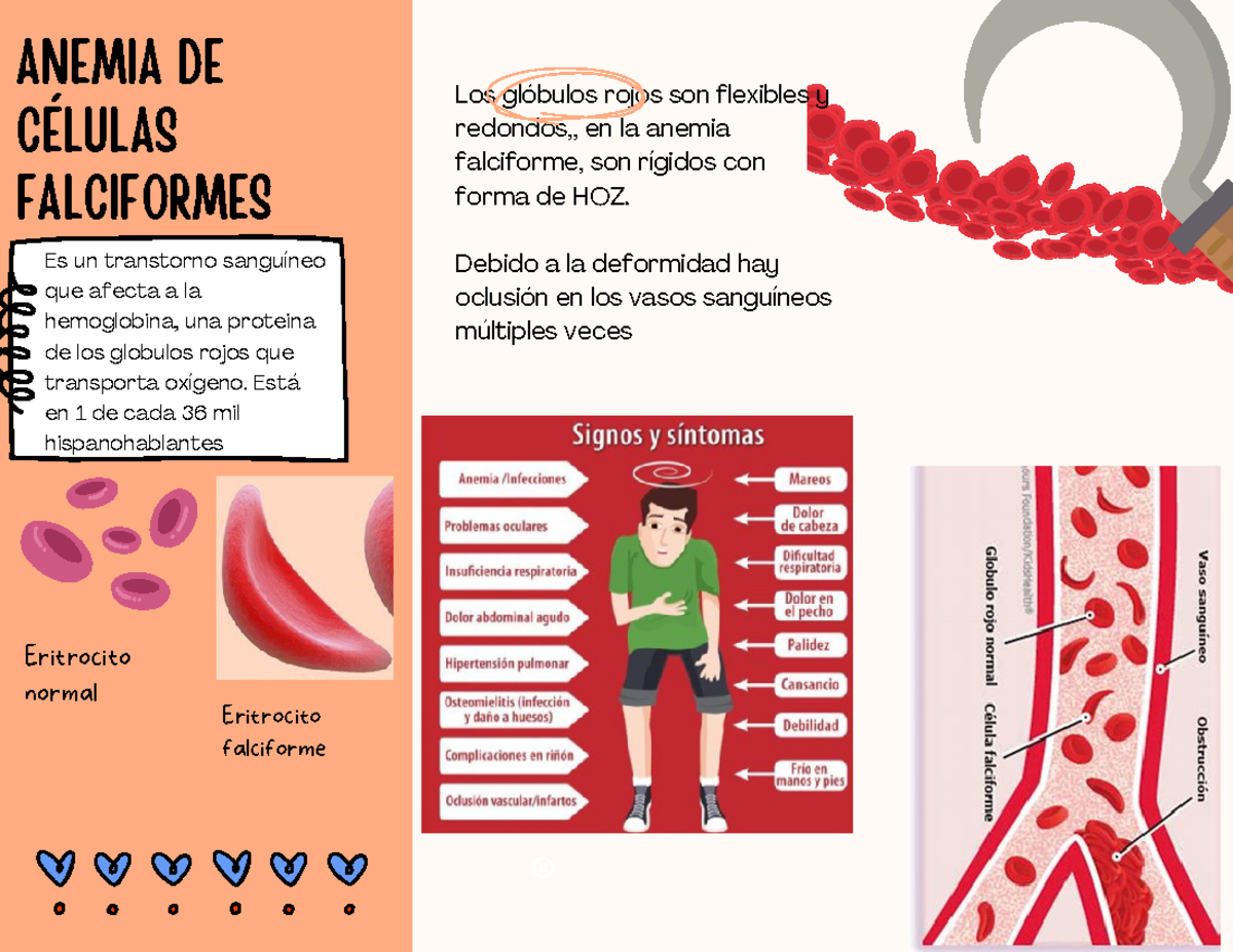 Folleto Informativo sobre Anemia Falciforme y su Manejo Médicos - Studocu